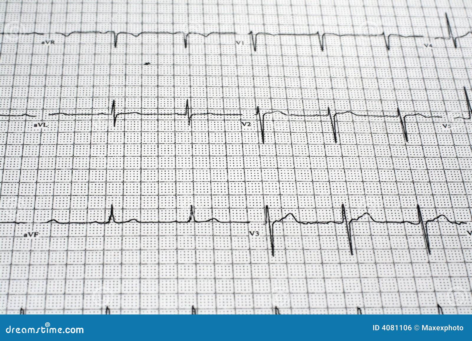 EKG Readout Stock Photography | CartoonDealer.com #4081106