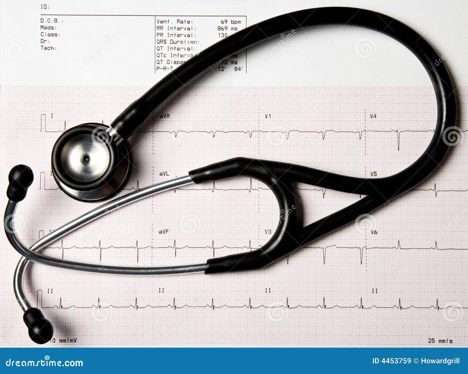 EKG and Stethoscope stock image. Image of doctor, care - 4453759
