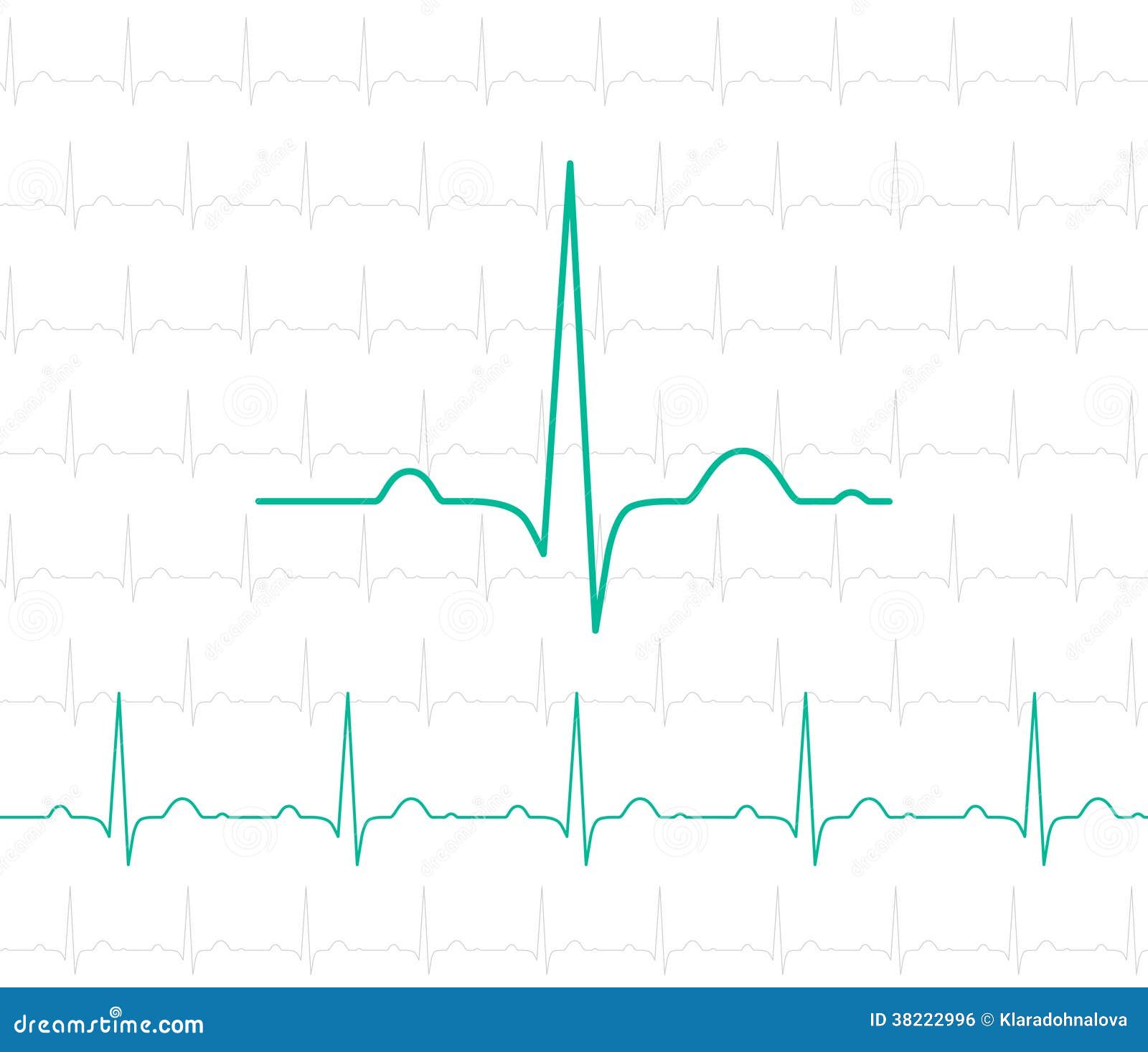 EKG Symbol On White - Medical Background Vector Illustration ...