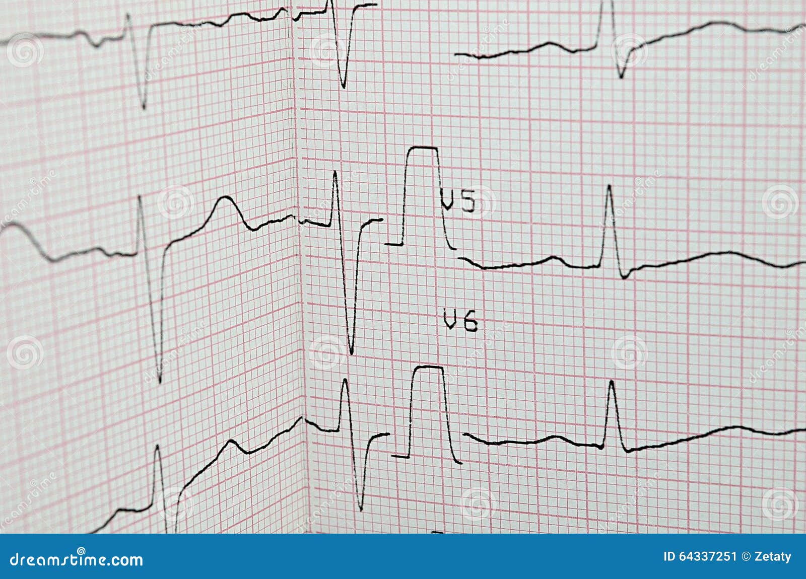 EKG test stock image. Image of checkup, background, draw - 64337251