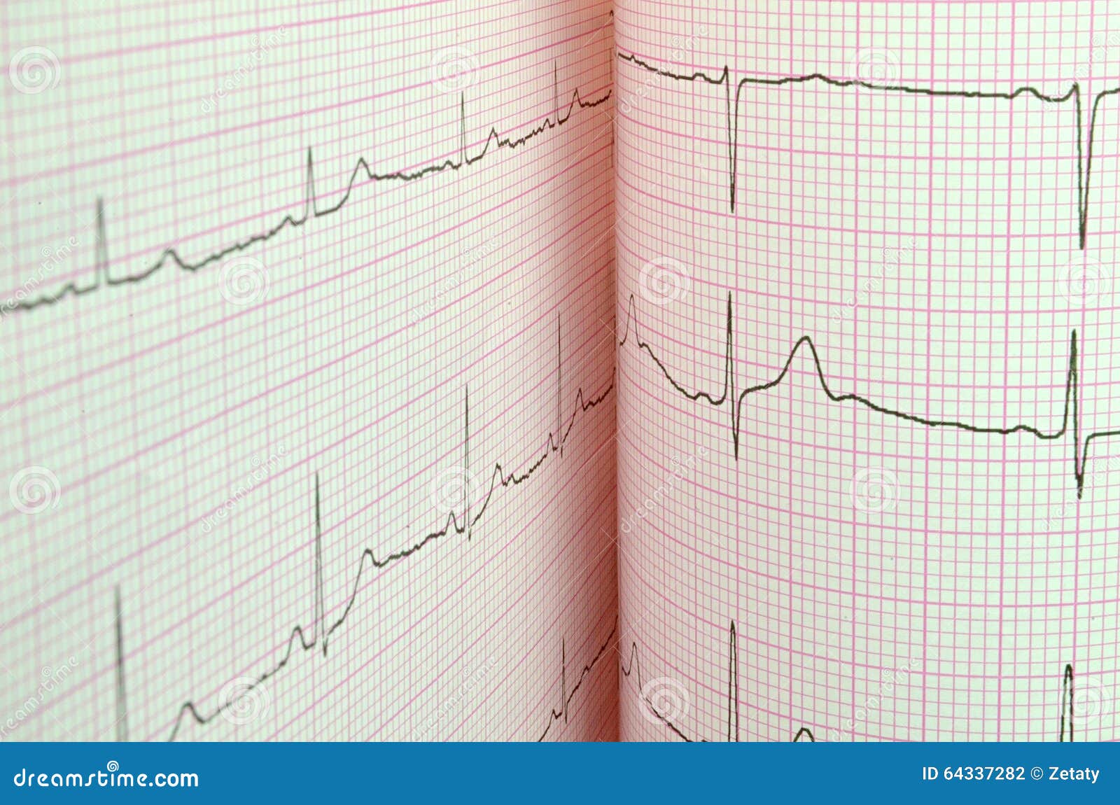 EKG test stock photo. Image of diagnose, electro, cardiovascular - 64337282