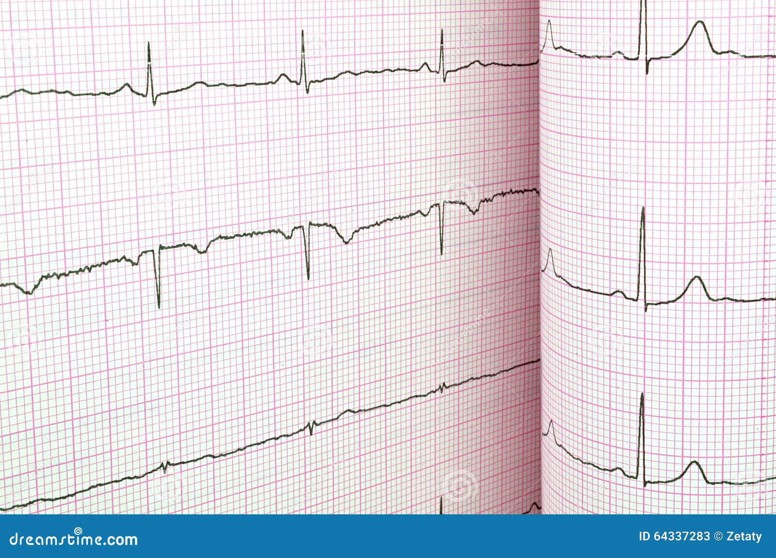 EKG test stock image. Image of beat, draw, analyse, graph - 64337283