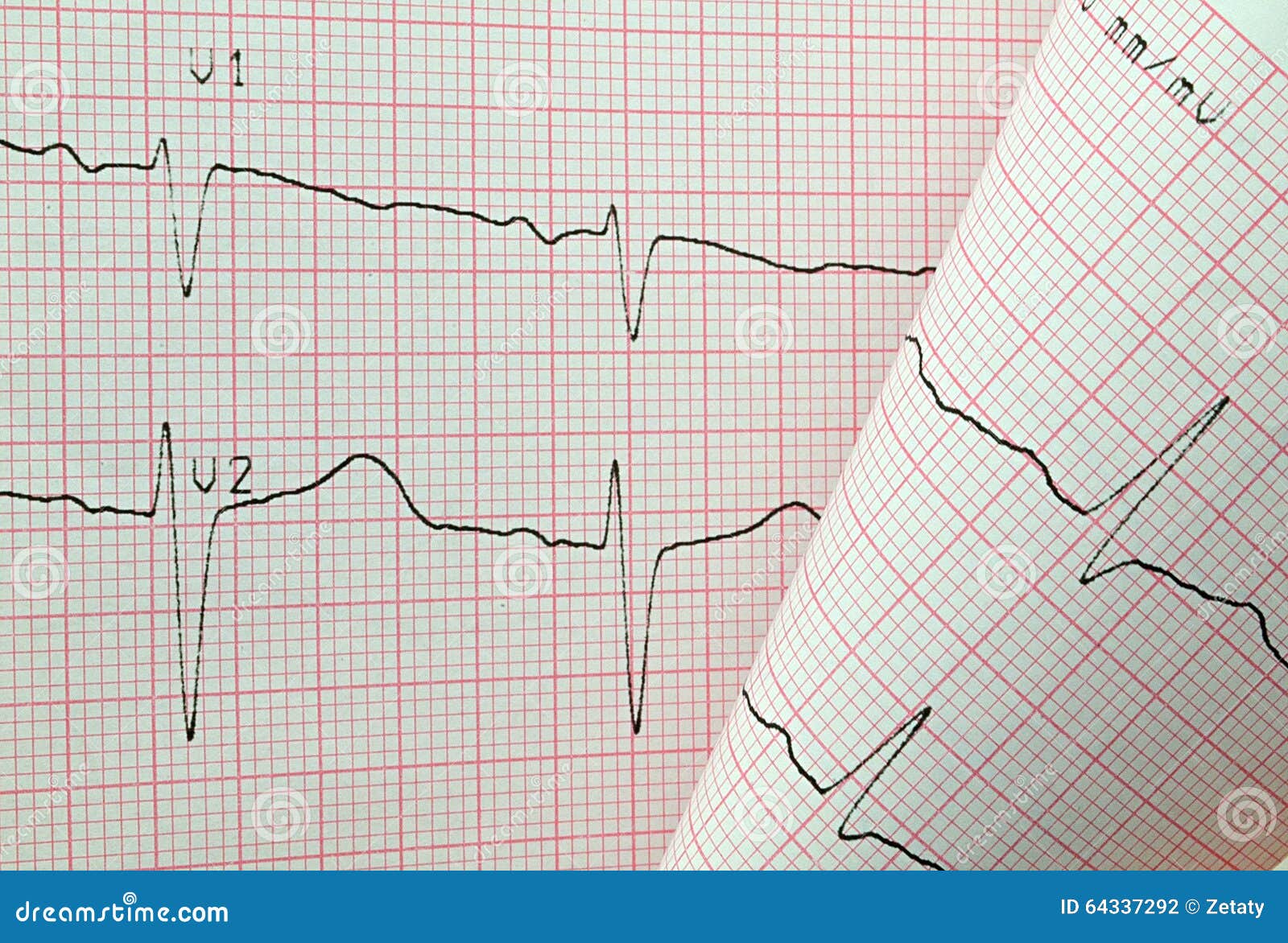EKG test stock photo. Image of heart, diagnostic, blood - 64337292