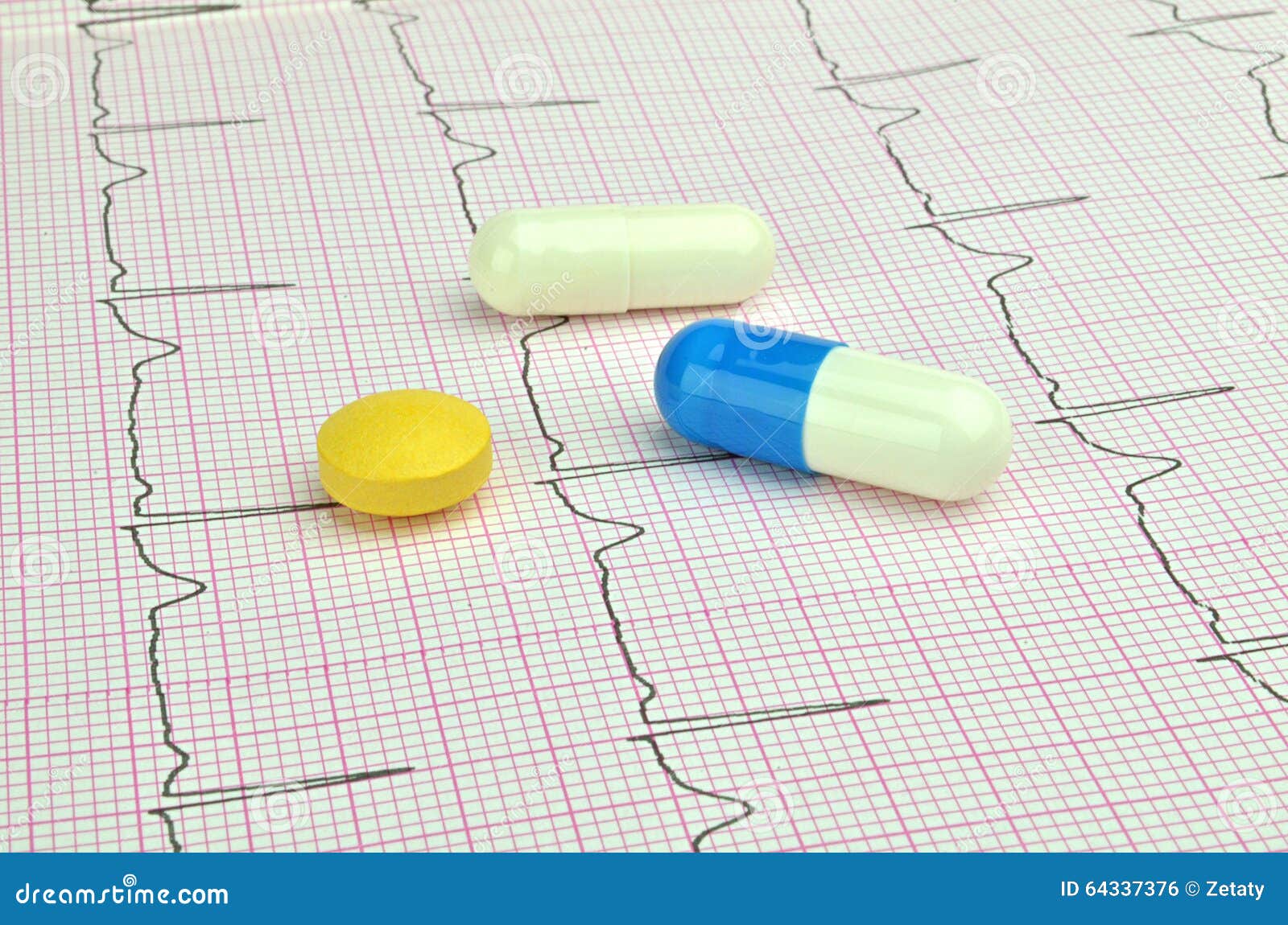 EKG test stock photo. Image of graph, cardiovascular - 64337376