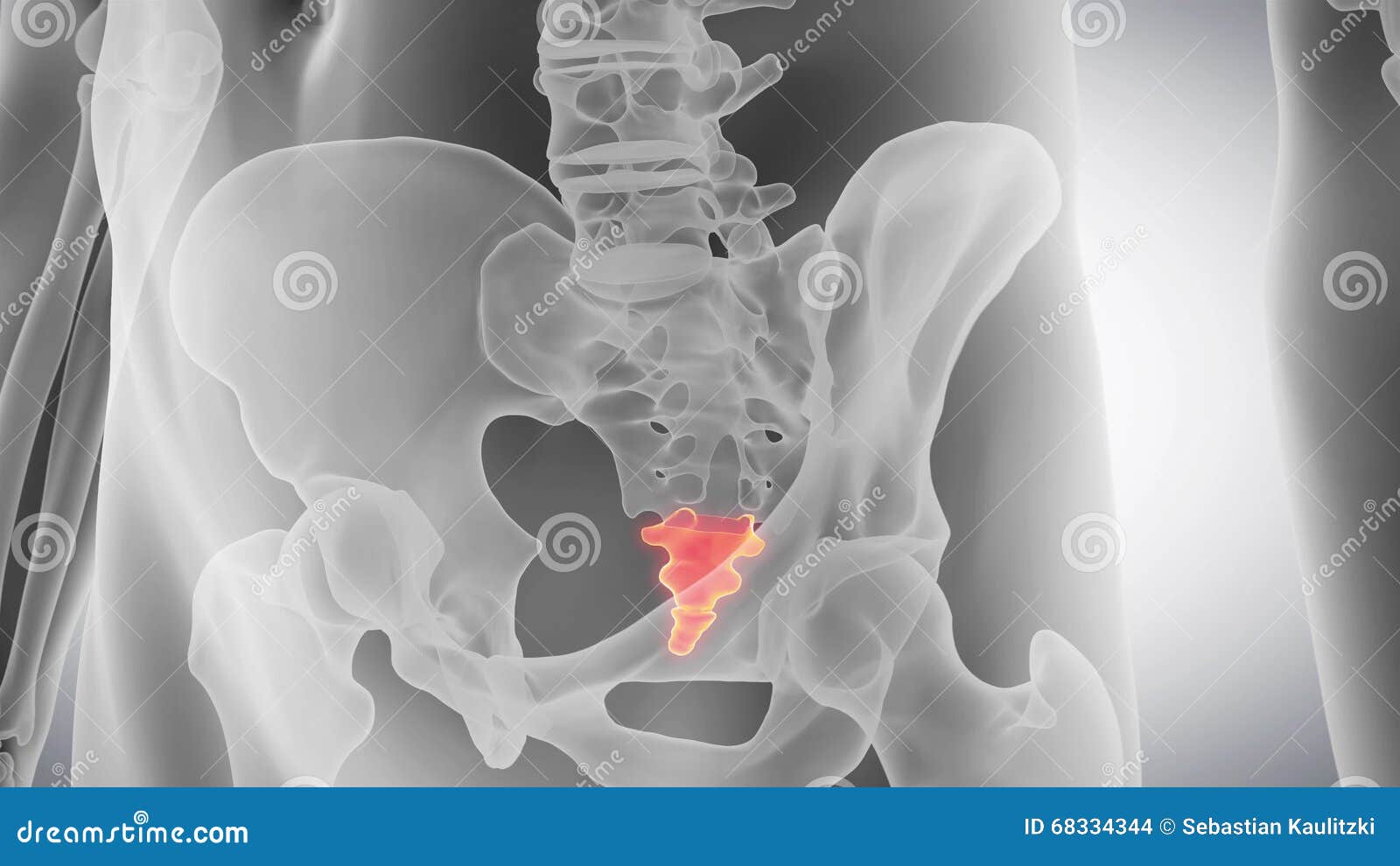 El coxis metrajes. Vídeo de dolor, gris, anaranjado, reumatismo - 68334344