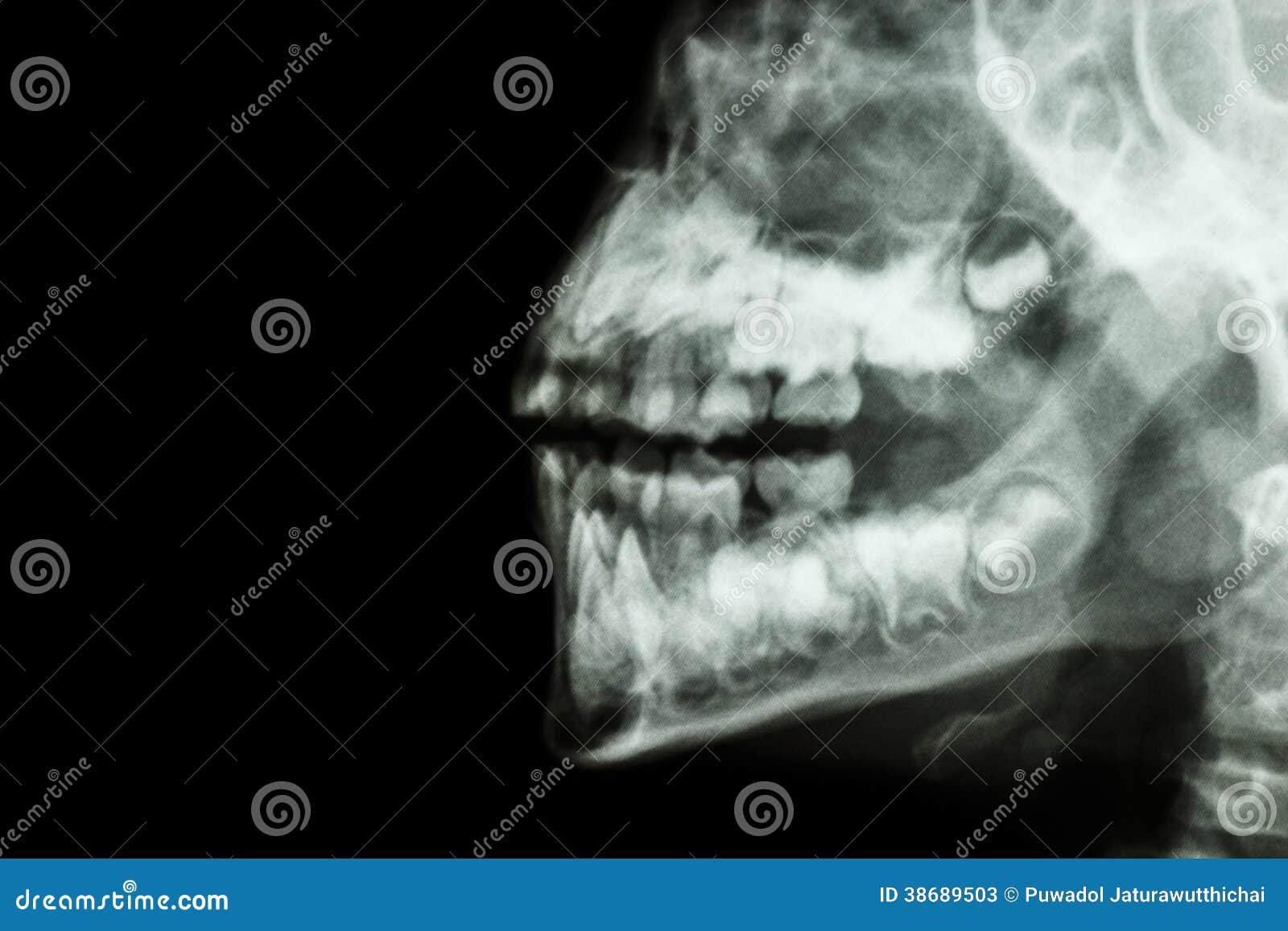 Colmillo Humano Stock Images - 448 Photos