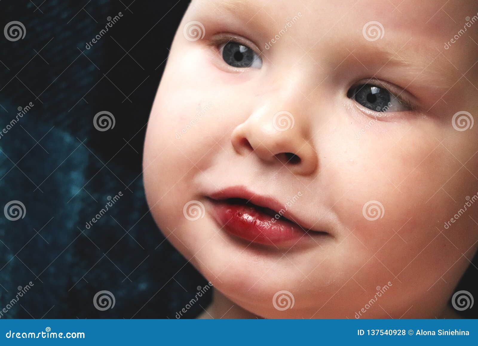 El Muchacho Tiene Una Herida Quebrada En Los Labios Foto de archivo ...