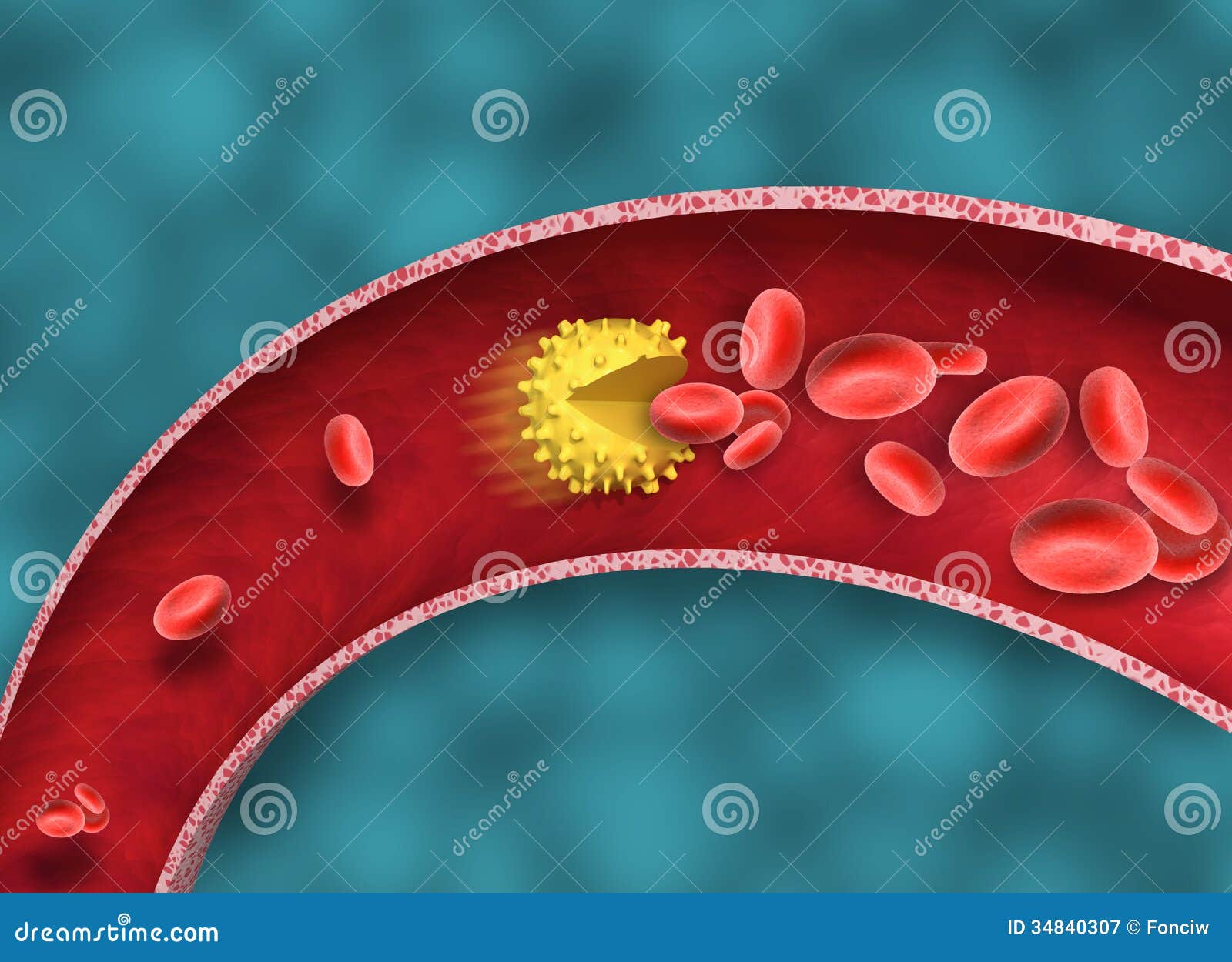 El Virus Ataca a Los Glóbulos Fotografía editorial - Ilustración de ...