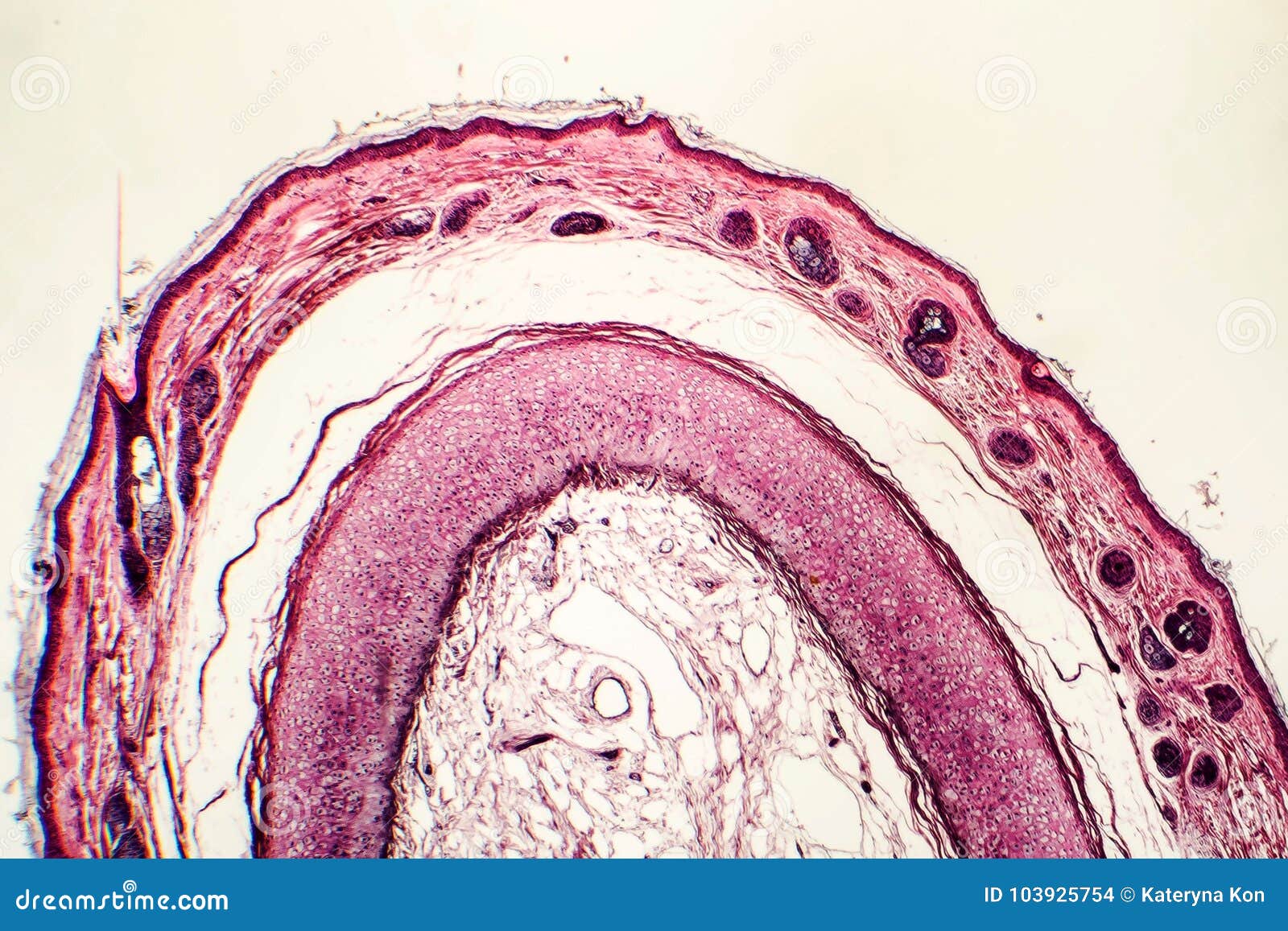 Ear Cartilage Histology