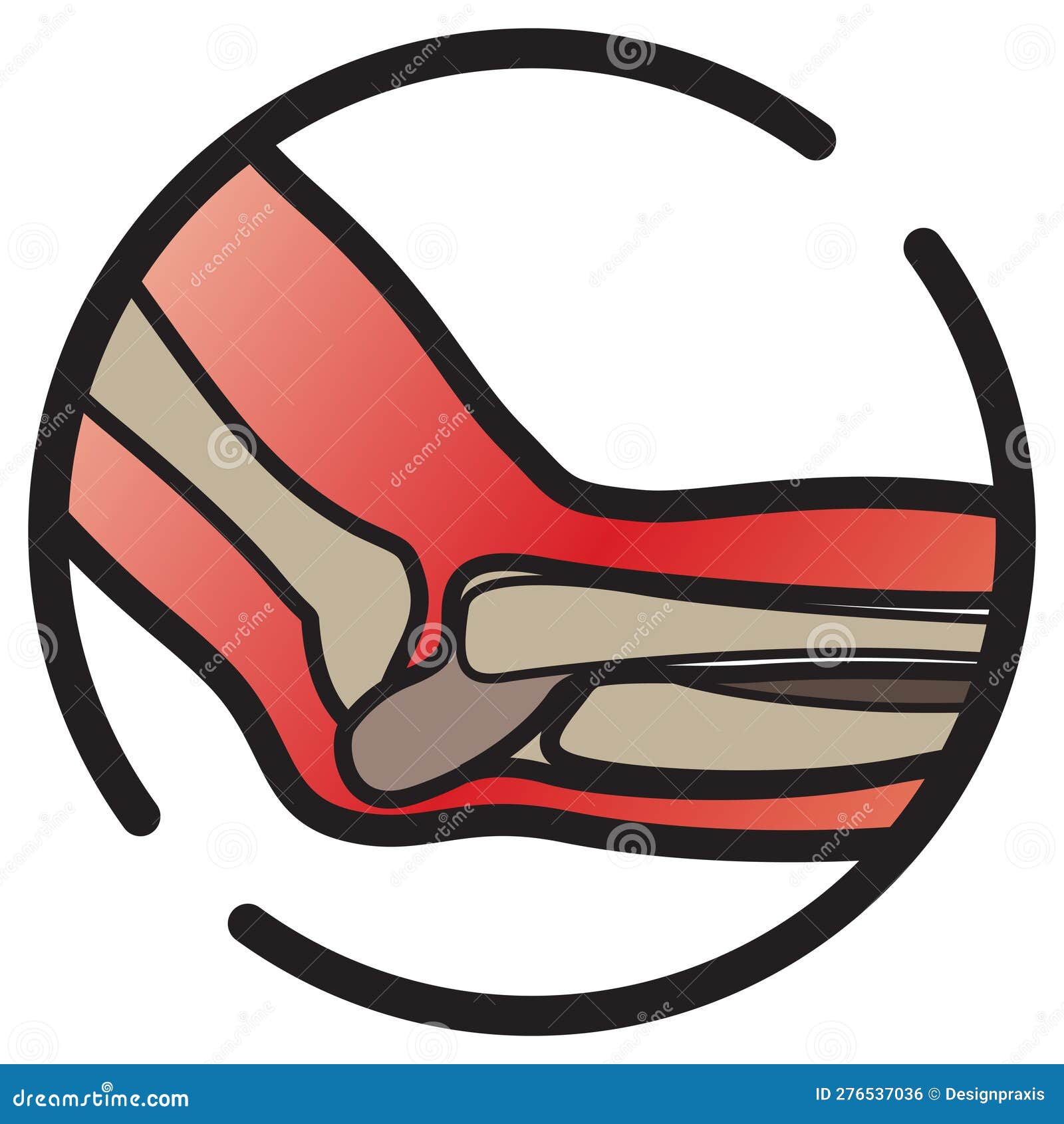 Elbow Bone Illustration, Pain, Forearm, Cramp, Illustration, Bone, Ache ...