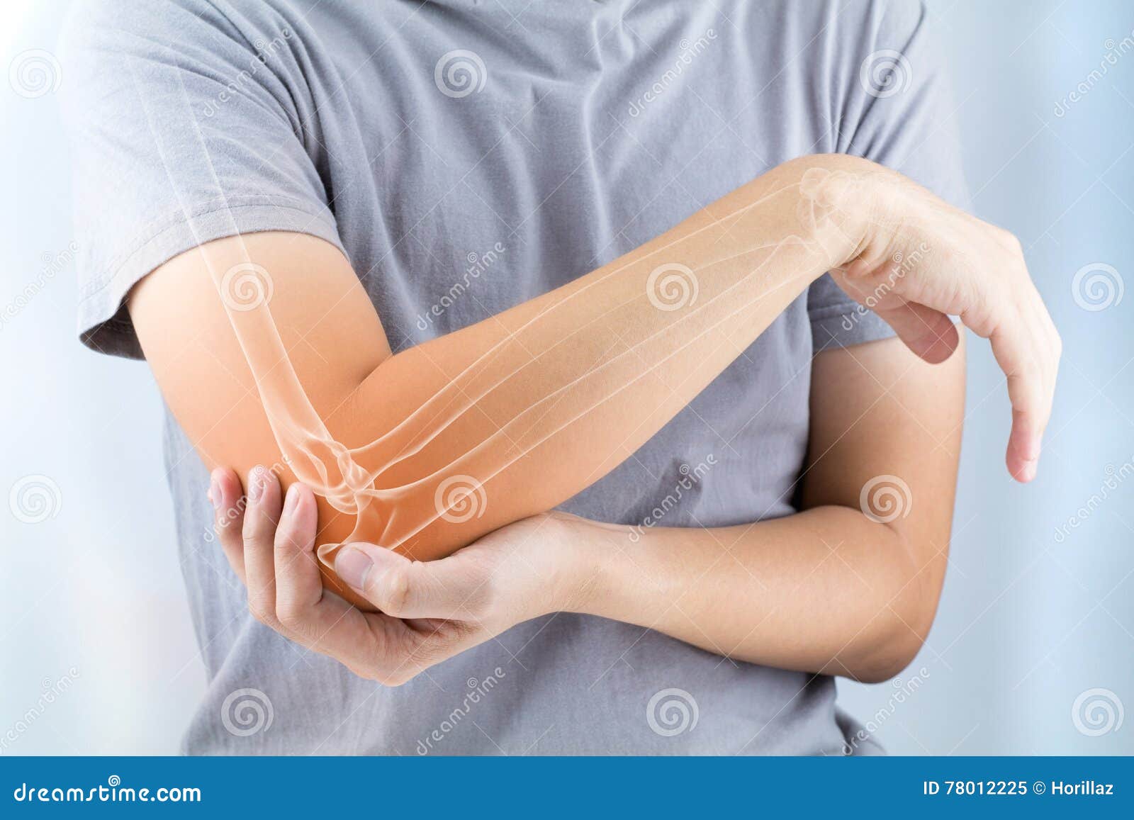 Elbow Pain. Closeup Beautiful Female Body With Pain In Arms Stock ...
