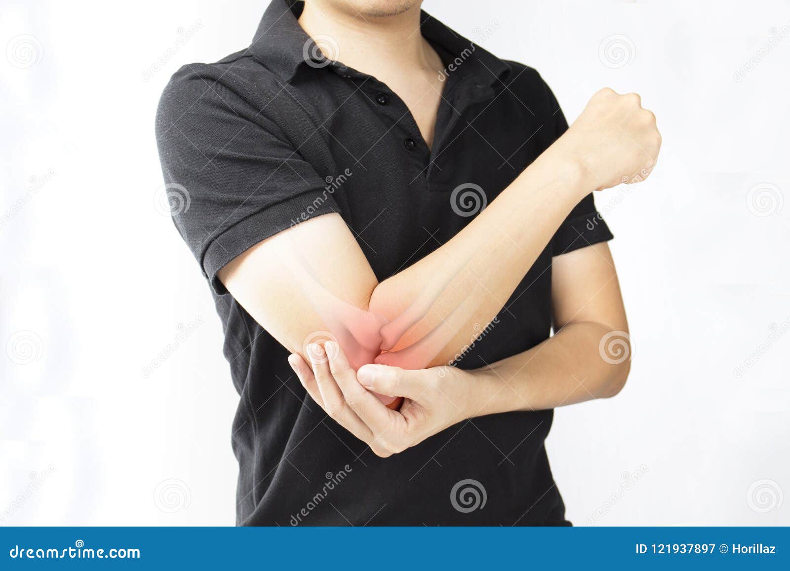 Elbow bones injury stock image. Image of bone, cramp - 121937897