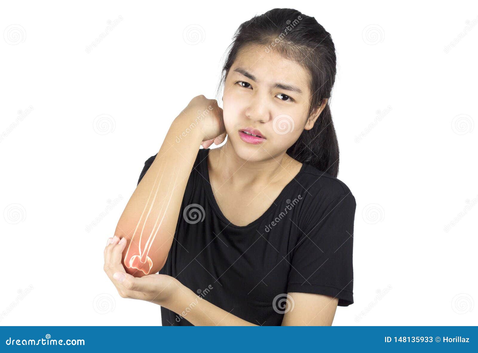 Elbow bones injury stock image. Image of osteoporosis - 148135933
