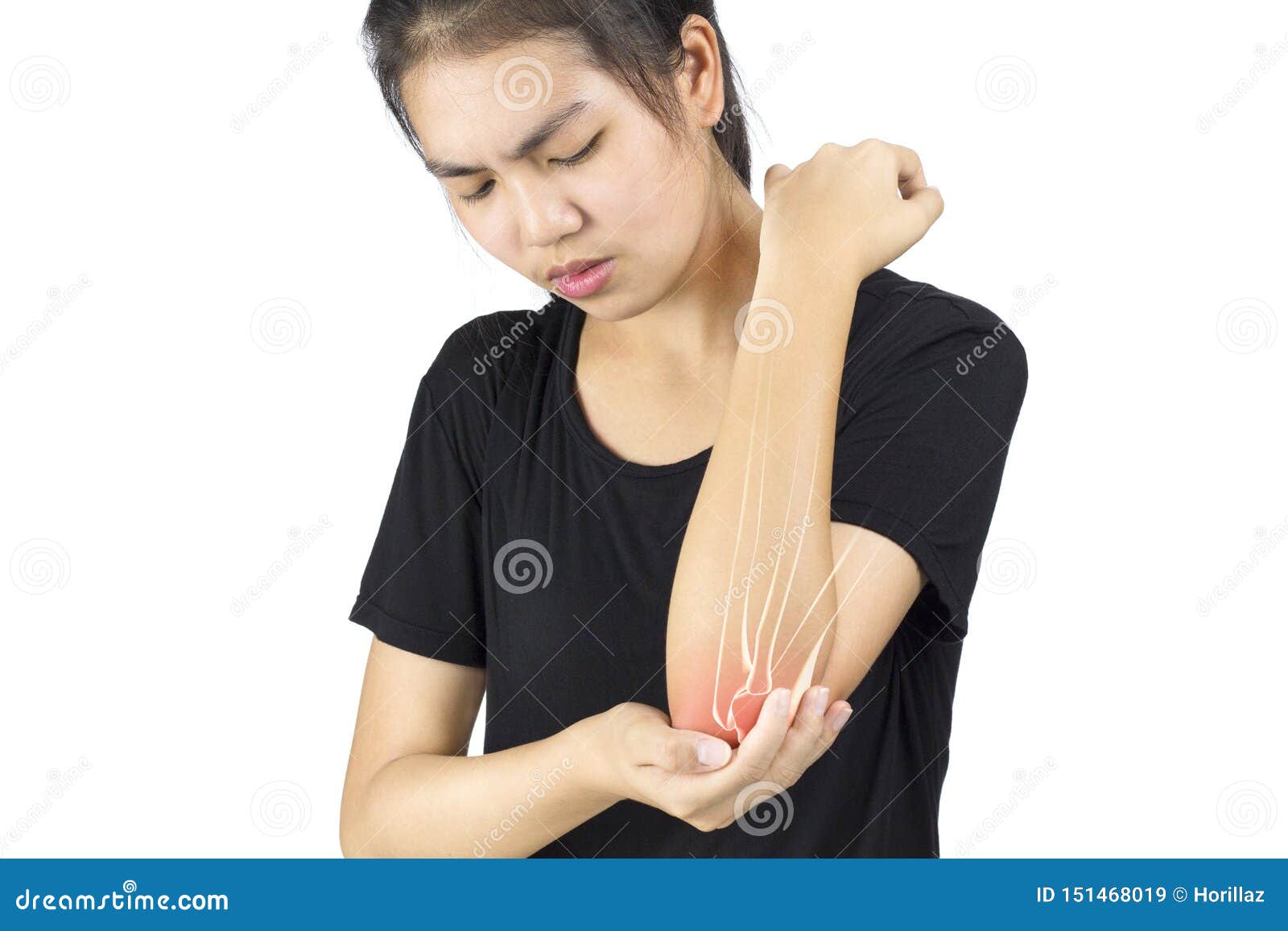 Elbow bones injury stock image. Image of bone, physical - 151468019