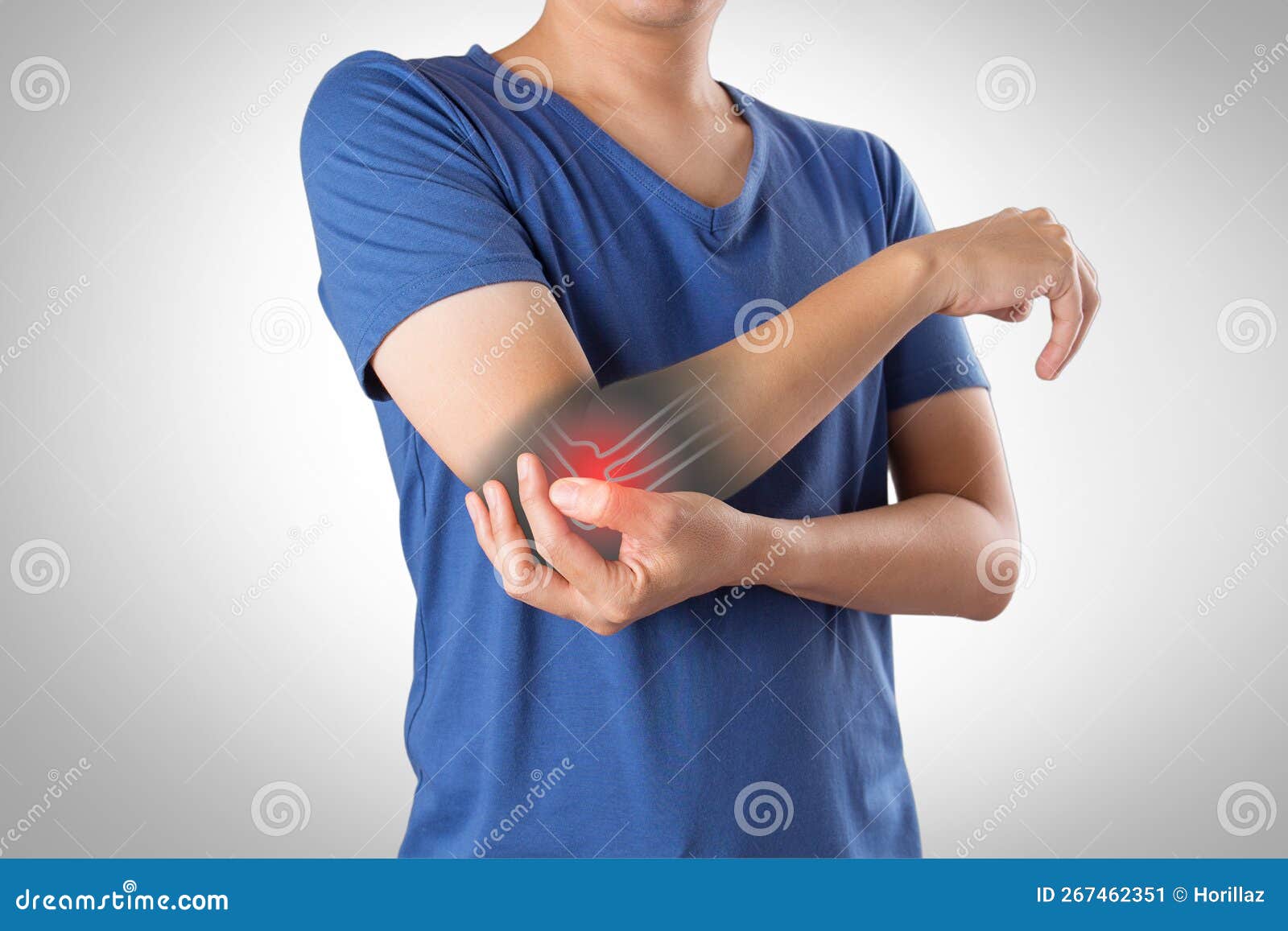 Elbow Bones Injury White Background Elbow Pain Stock Illustration ...