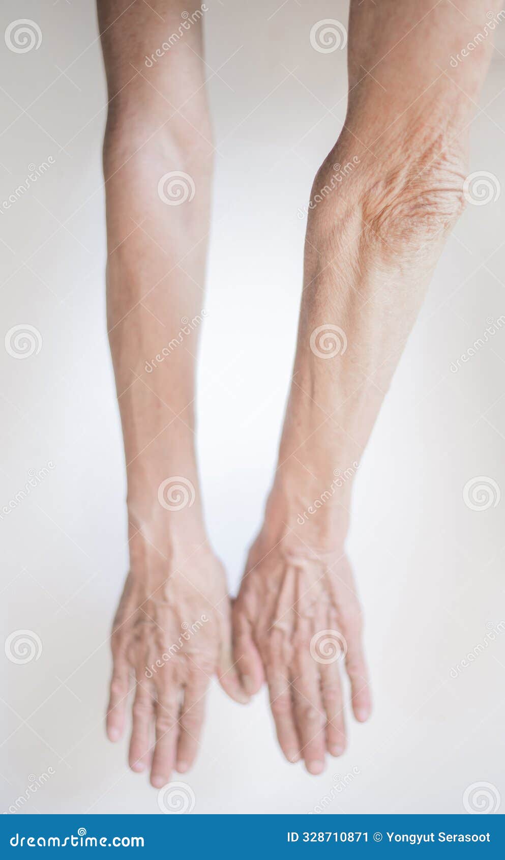 Elbow bones, unusual arm stock image. Image of contort - 328710871