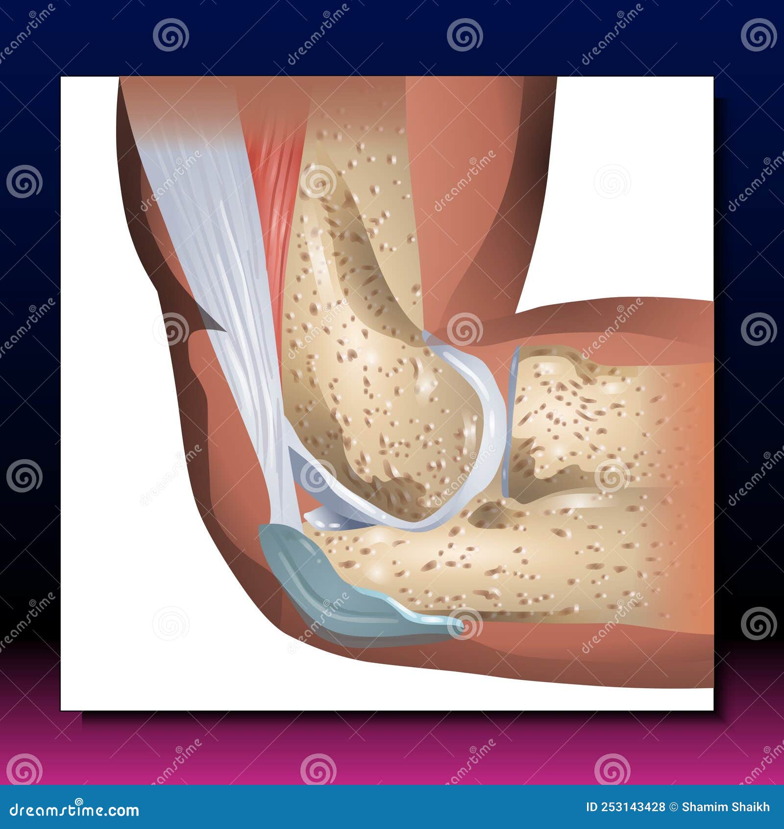Elbow Dislocation, Elbow Bone Illustration, Pain, Forearm, Cramp ...