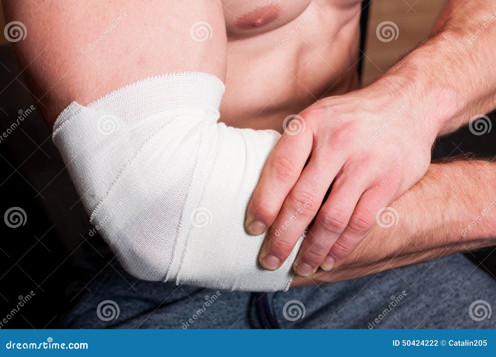 Elbow injury stock photo. Image of medicine, misery, emergency - 50424222