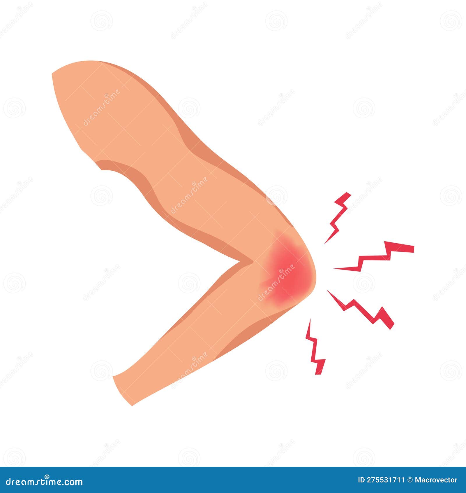 Elbow Injury Illustration stock vector. Illustration of hurt - 275531711