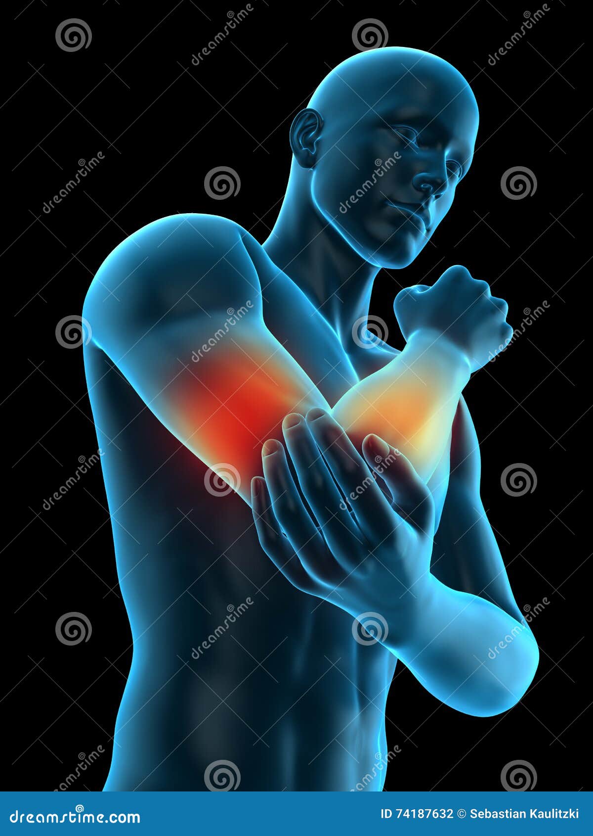 Elbow pain stock illustration. Illustration of anatomical - 74187632