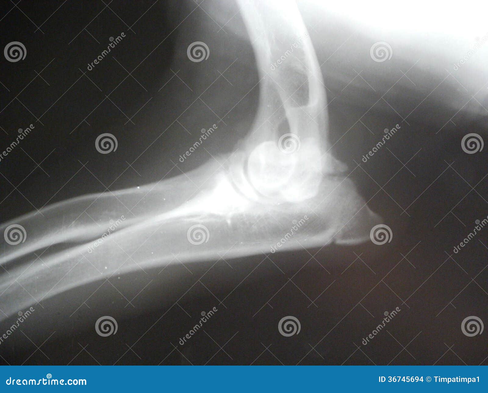Elbow - Ununited Processus Anconeus, Dog Stock Photo - Image of hound ...