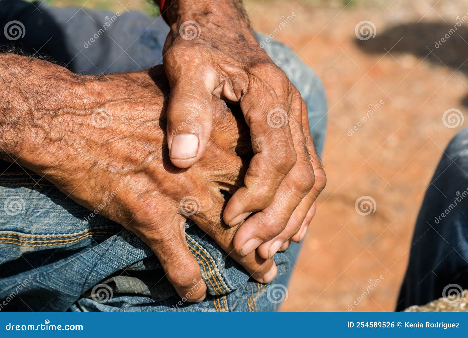 Elderly Callous Hands of a Latin Man Resting One upon the Other Stock ...