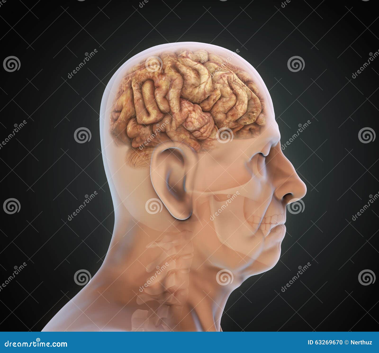 Elderly Male with Unhealthy Brain Stock Illustration - Illustration of ...