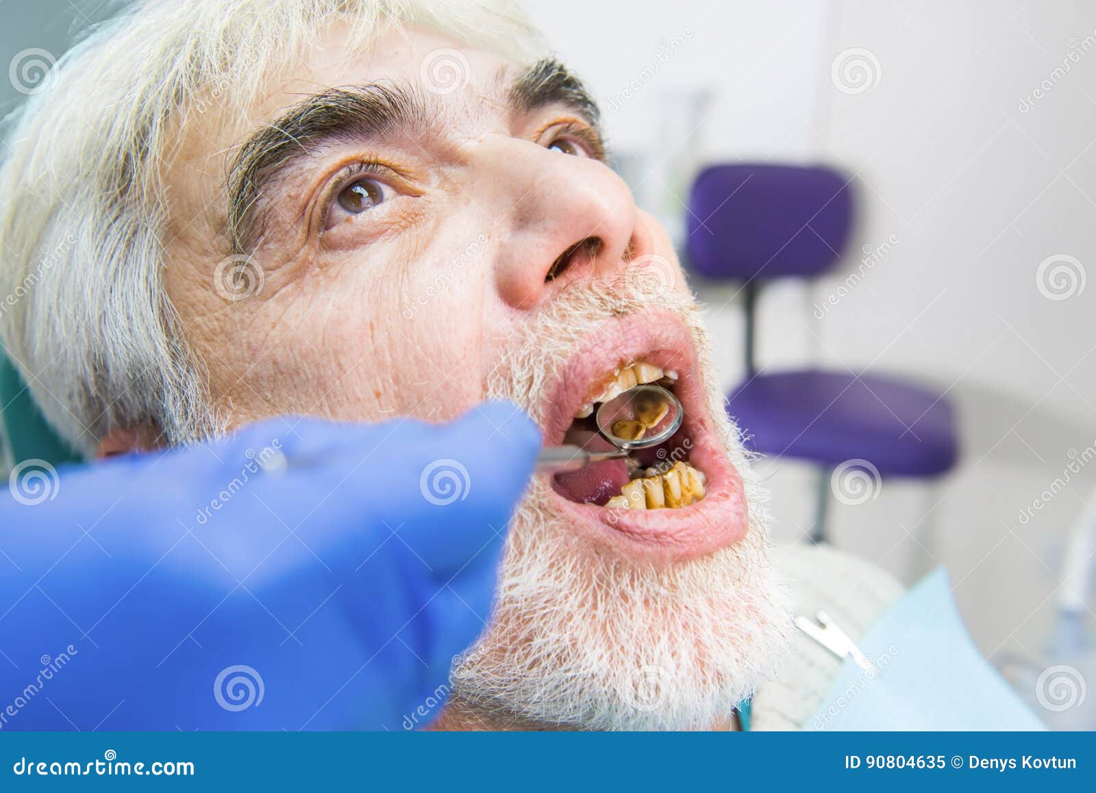 Elderly Man with Bad Teeth. Stock Image - Image of business, dentist ...
