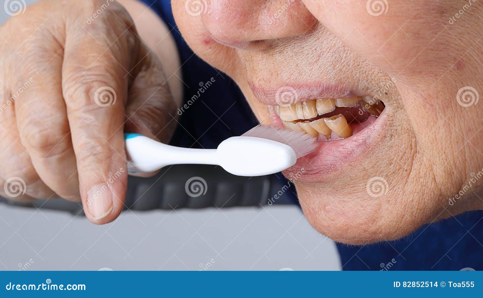 Elderly tooth attrition stock photo. Image of pensioner - 82852514
