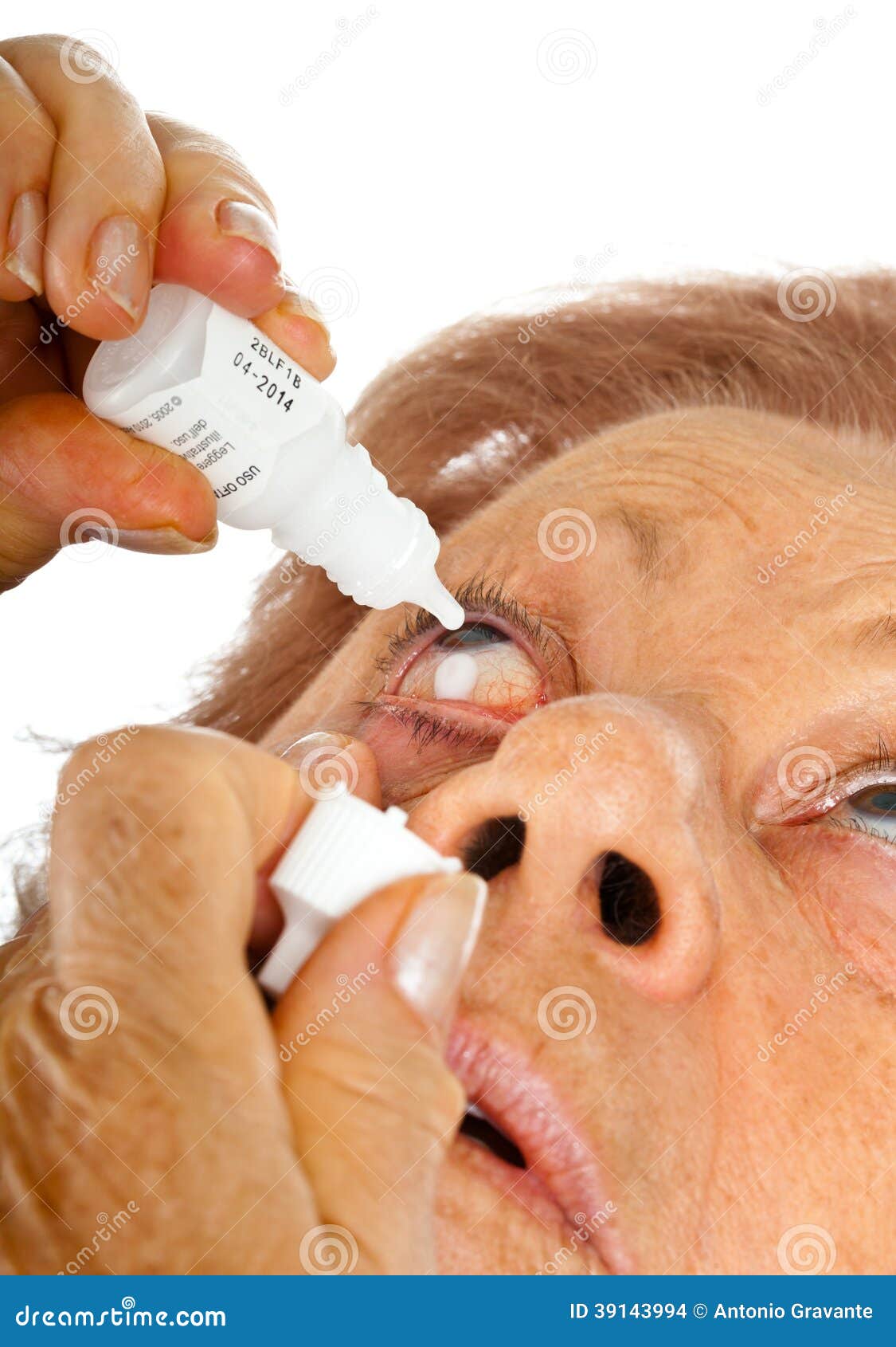 Elderly Woman Applying Eye Drops Stock Photo - Image of putting, drop ...