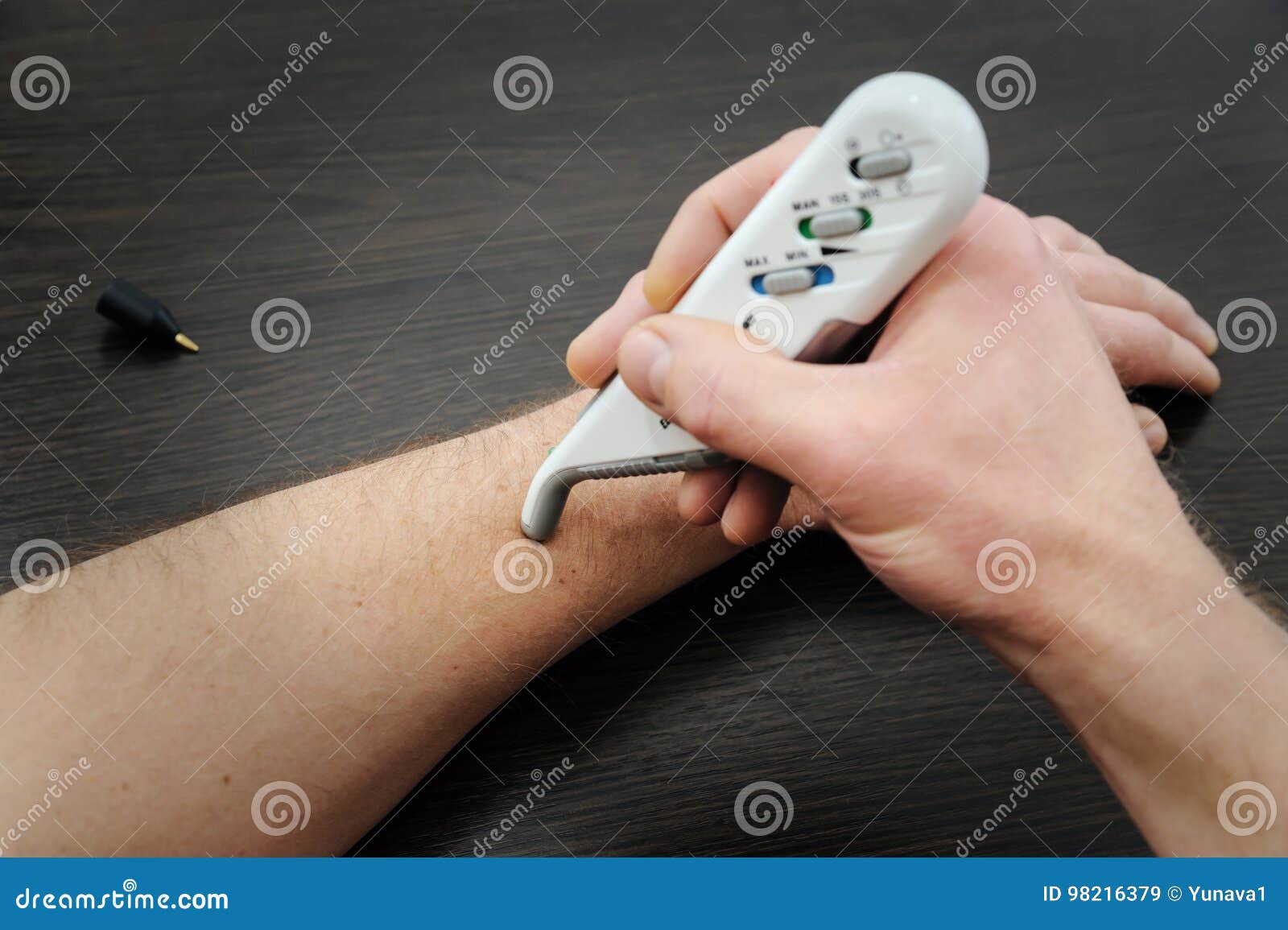 Electro Acupuncture Session. Stock Image - Image of device, frequency ...