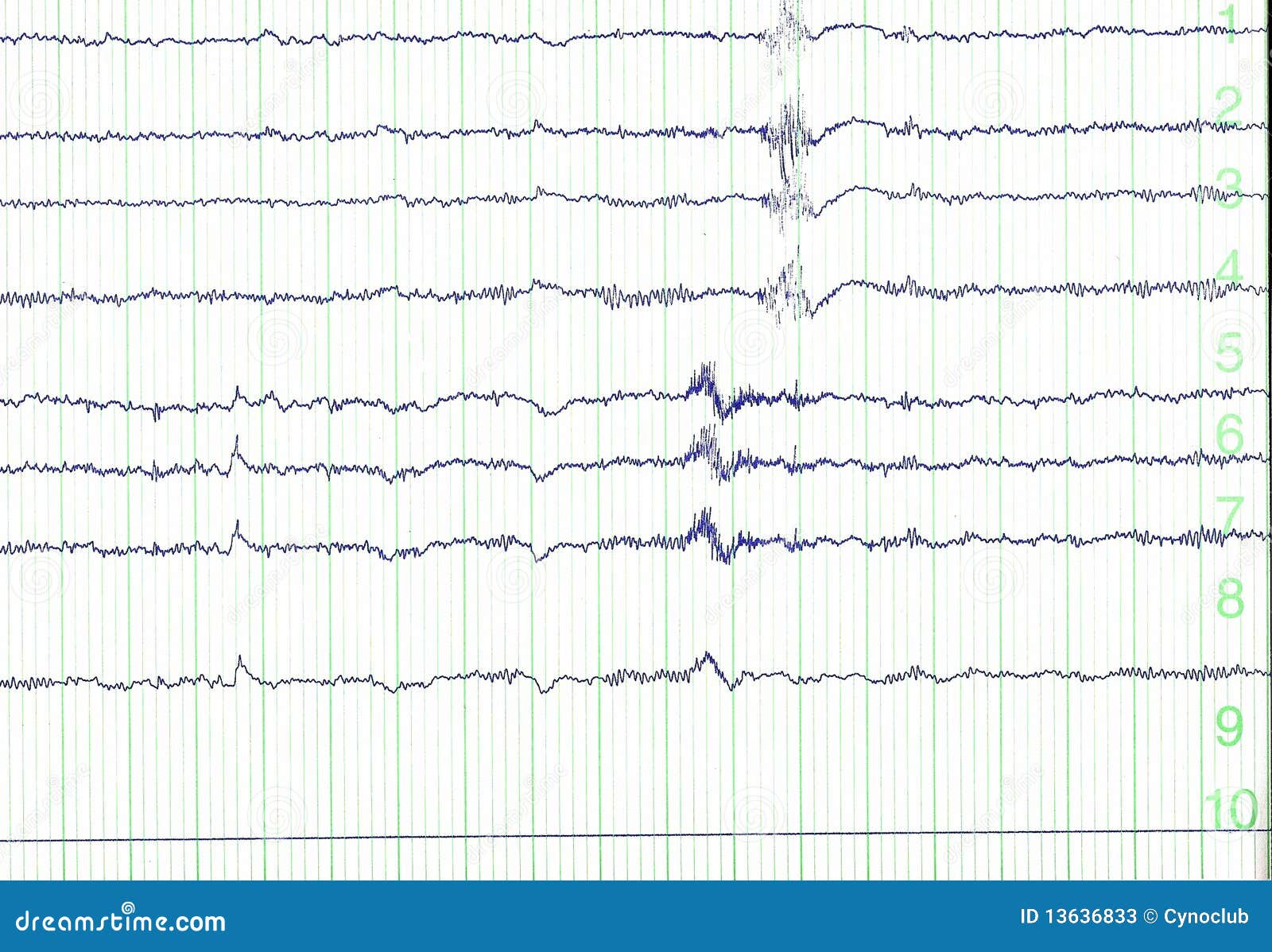 Electro-encephalogramme Royalty-Free Stock Photo | CartoonDealer.com ...