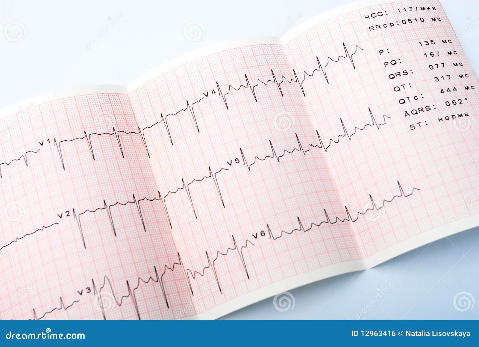Electrocardiogram stock photo. Image of heartbeat, paper - 12963416