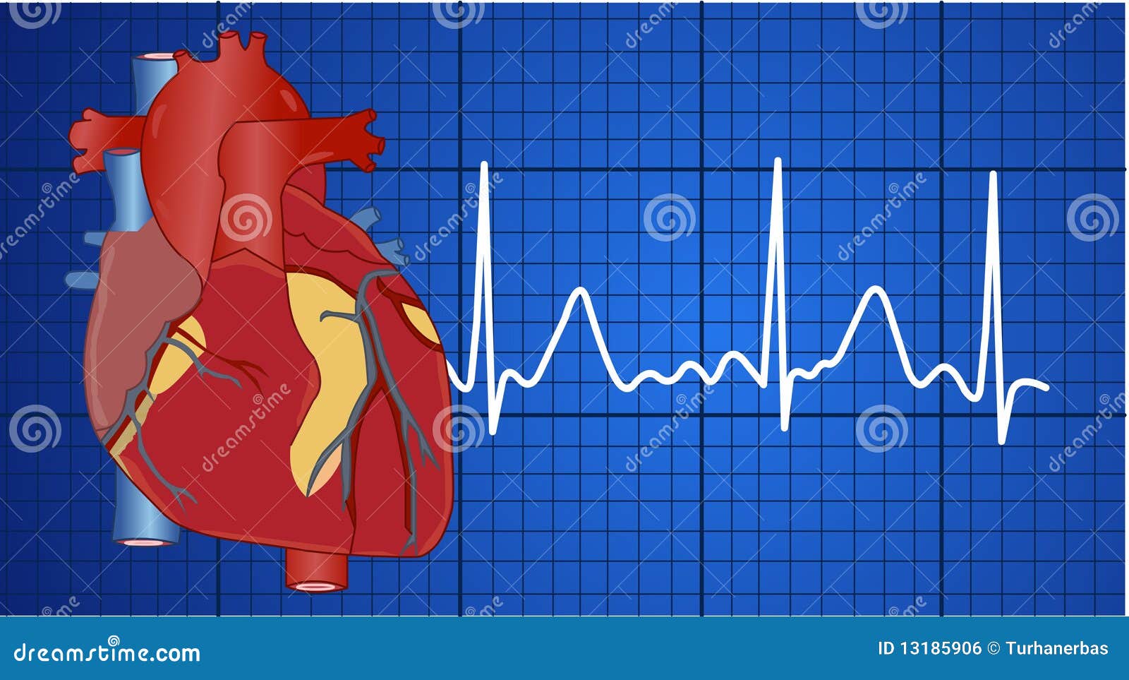 Electrocardiogram stock vector. Illustration of analysis - 13185906