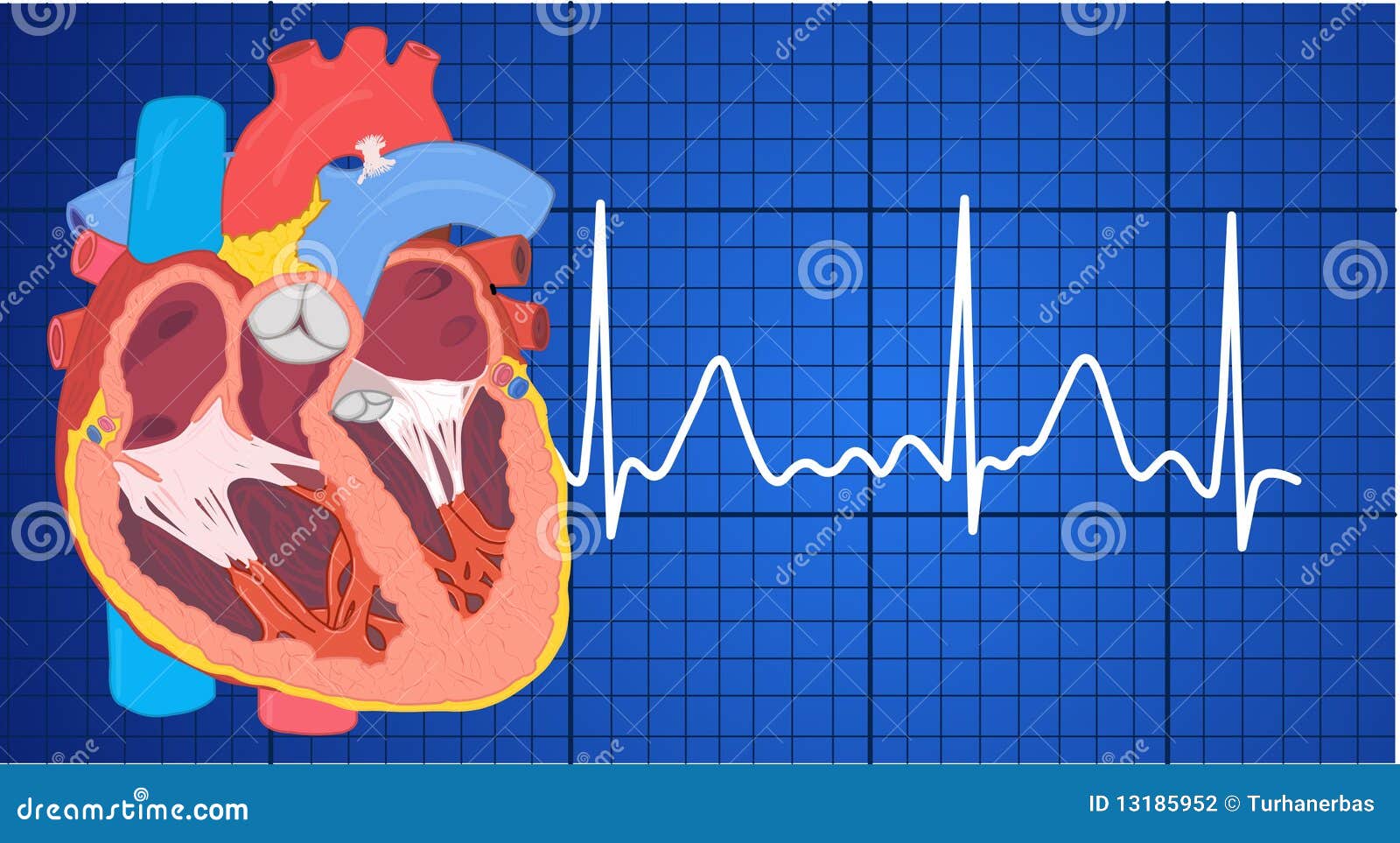 Electrocardiogram stock vector. Illustration of analyze - 13185952