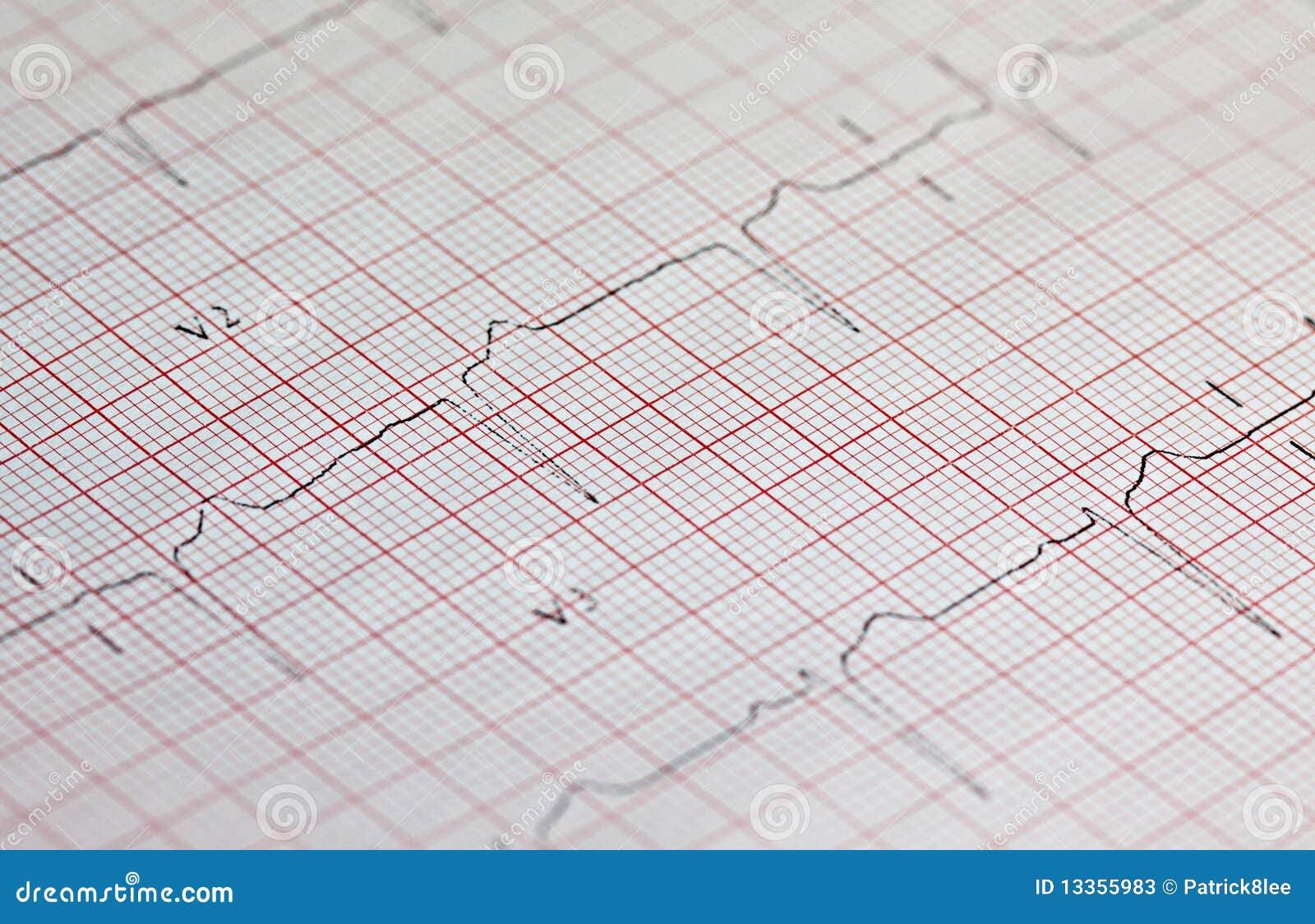 Electrocardiogram stock image. Image of chart, medical - 13355983