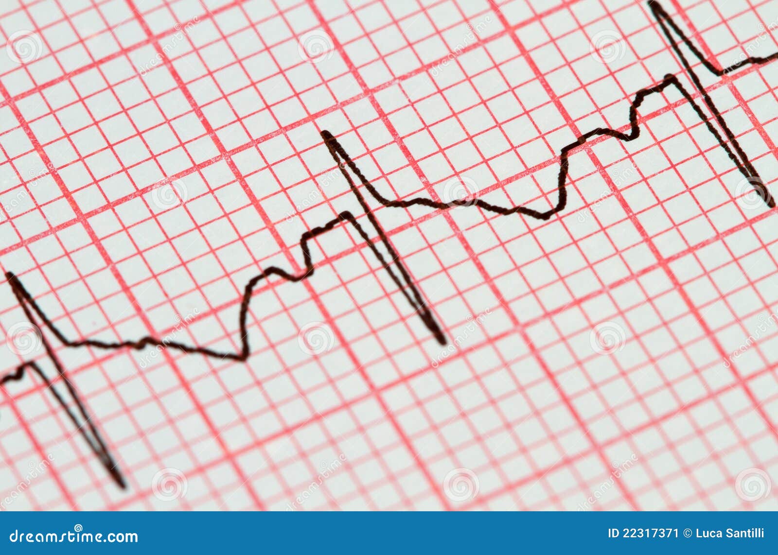 Electrocardiogram stock image. Image of cardiologist - 22317371