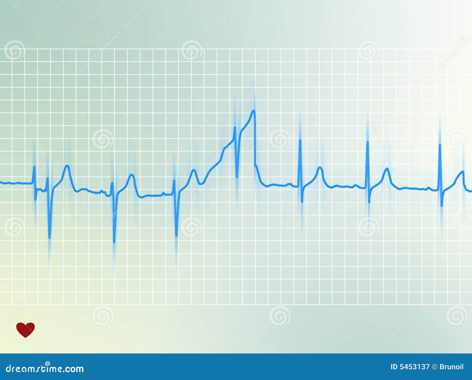 Electrocardiogram stock illustration. Illustration of lines - 5453137