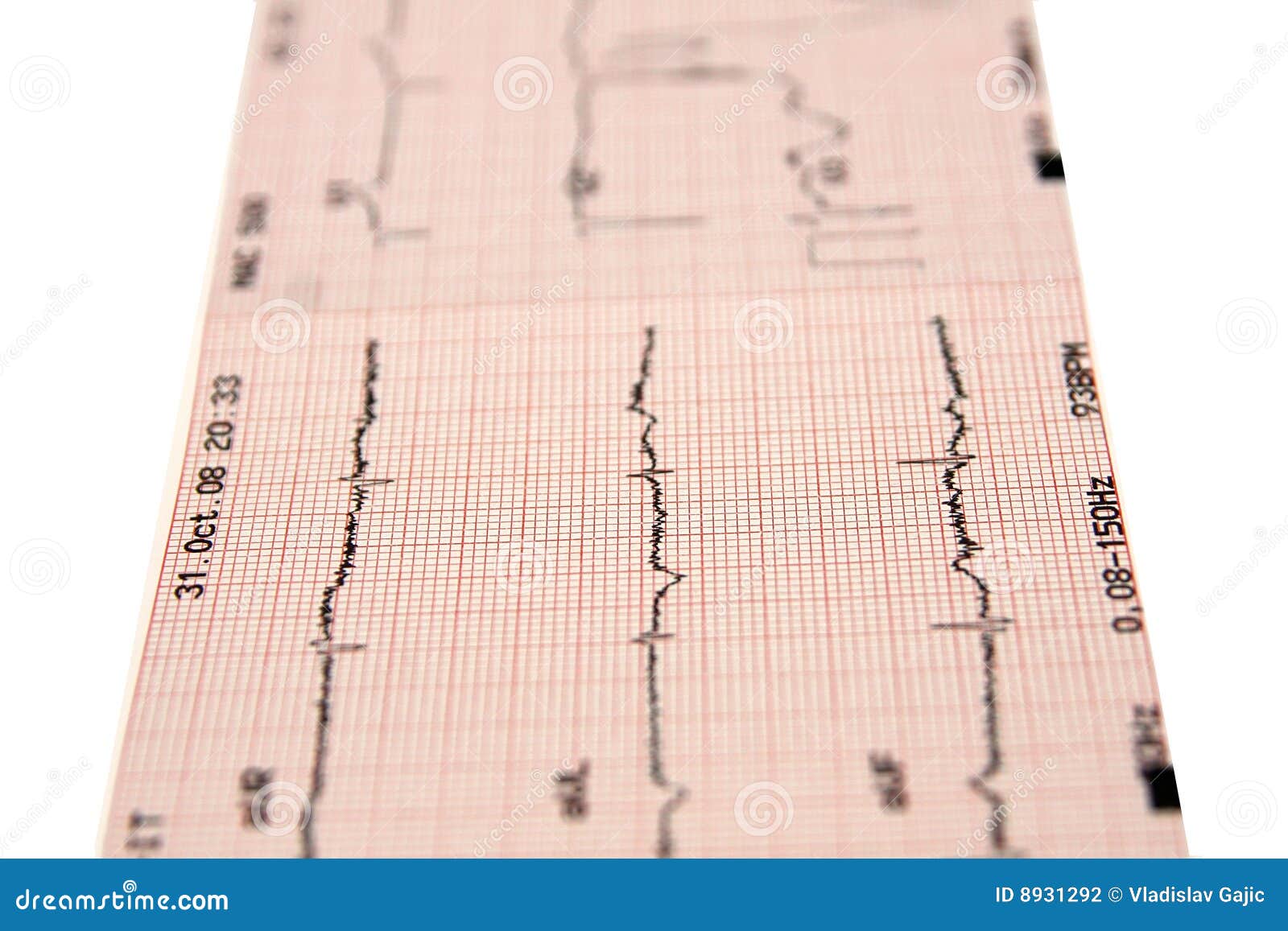 Electrocardiogram stock photo. Image of listening, scan - 8931292