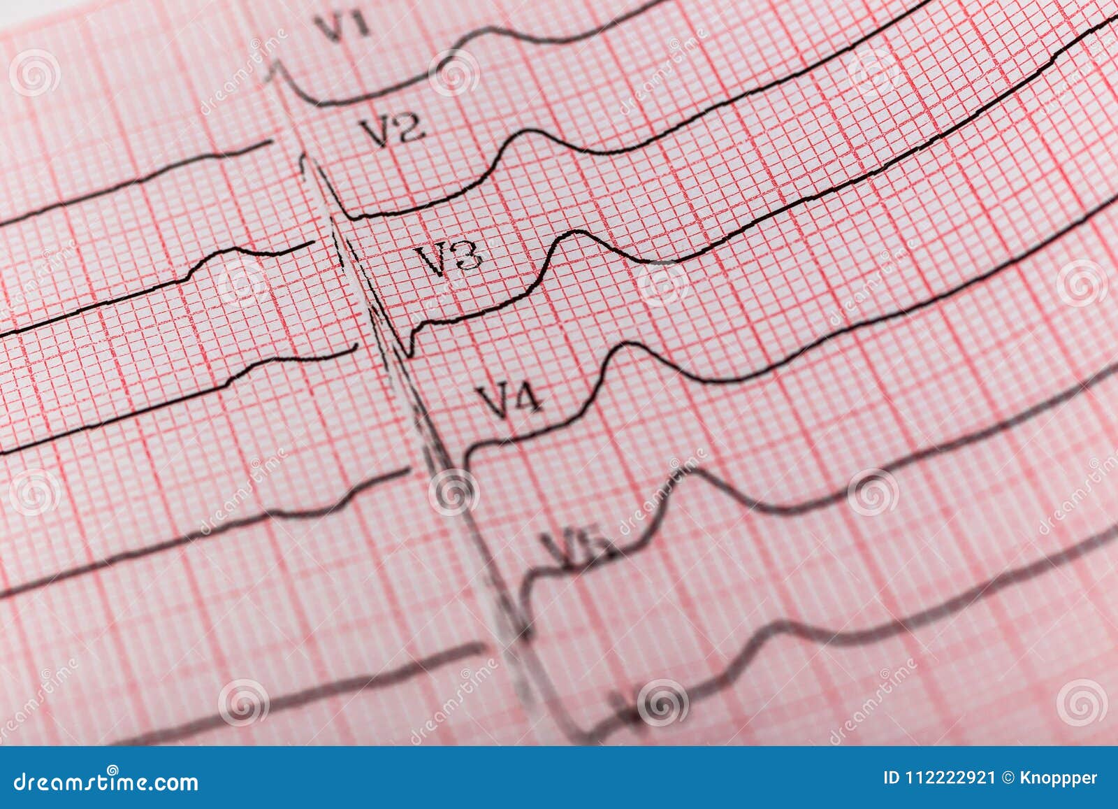 Electrocardiogram stock image. Image of chart, cardiac - 112222921