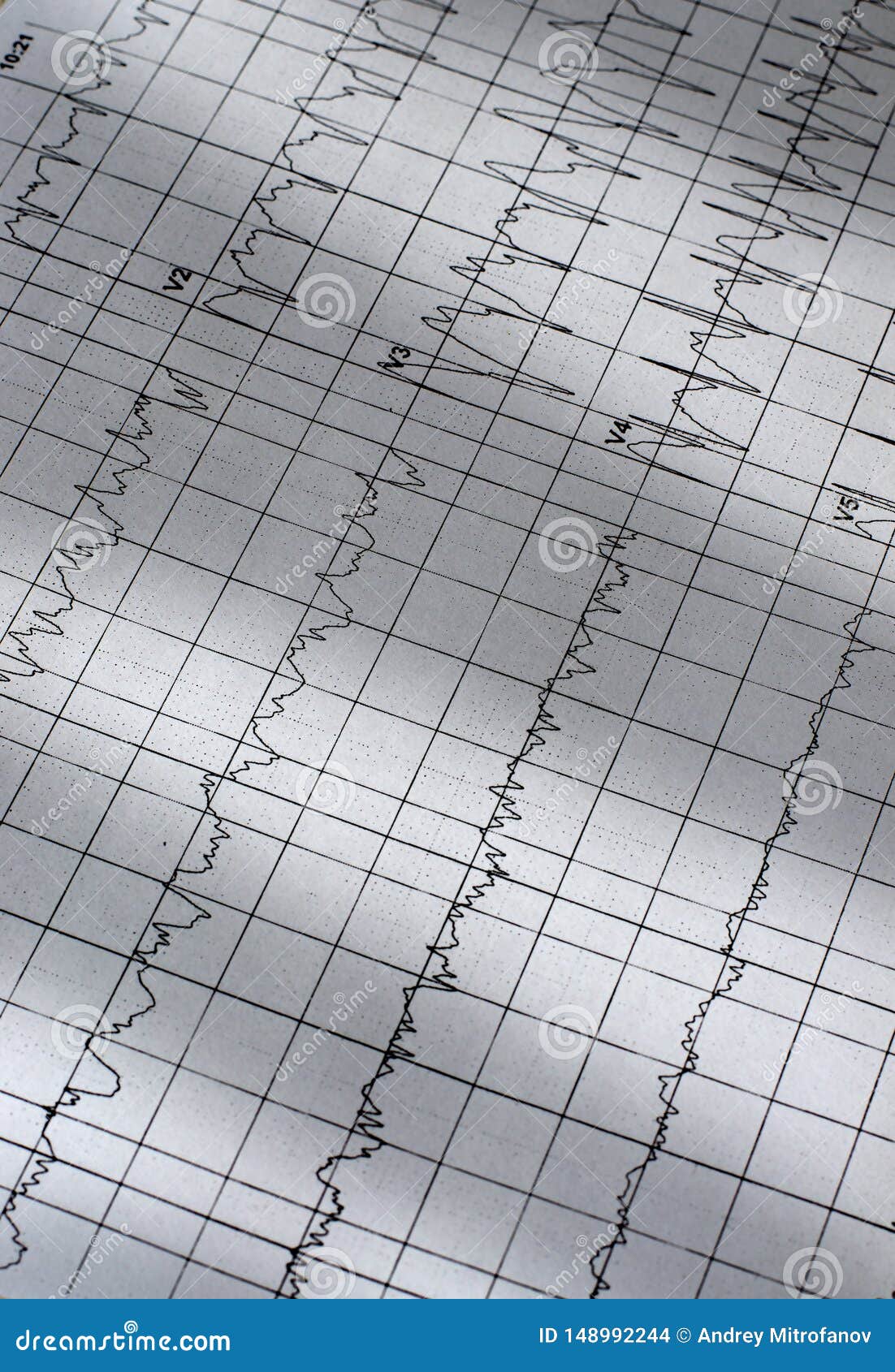 Electrocardiogram Chart As Medical Background Stock Photo - Image of ...