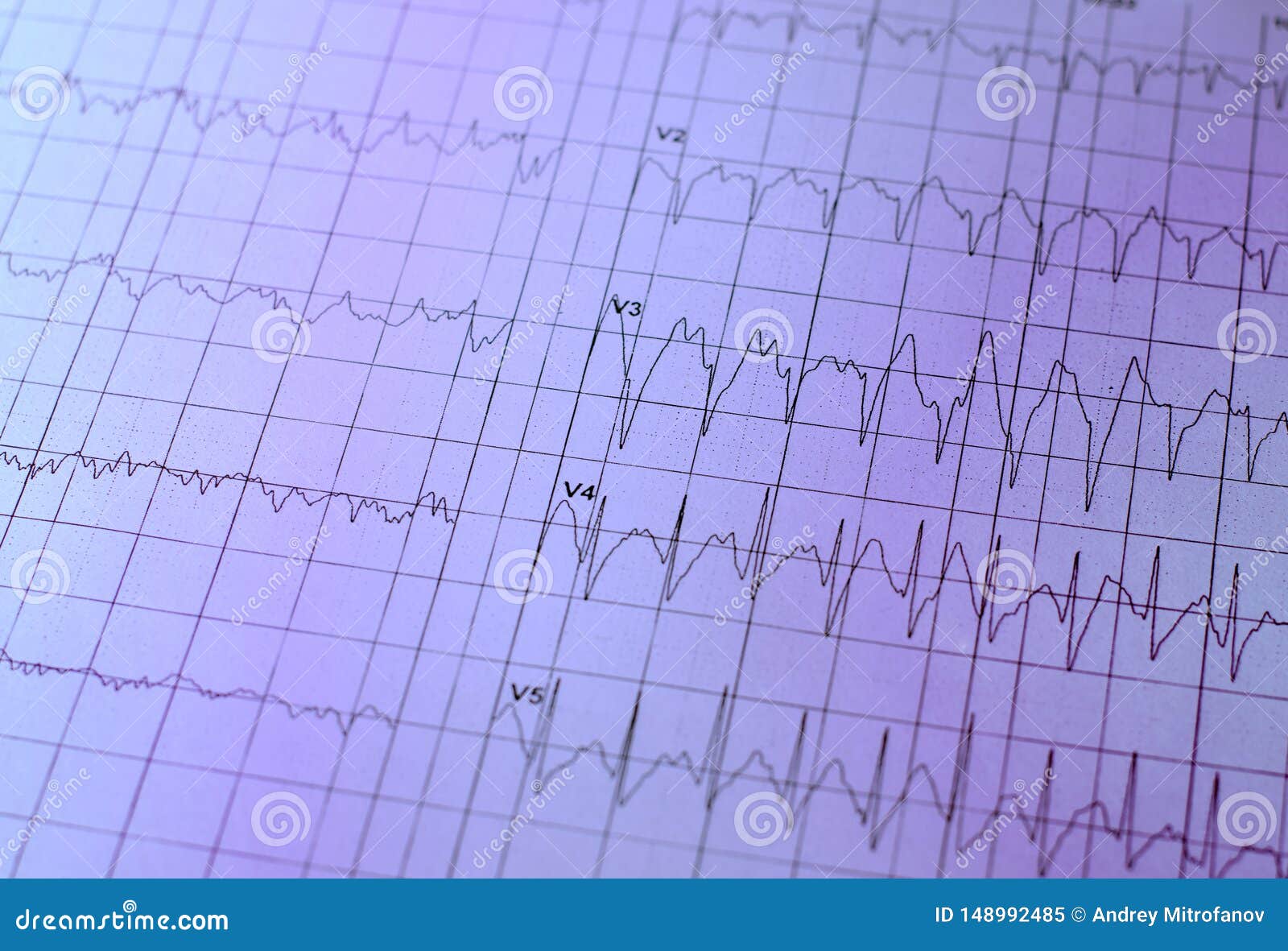 Electrocardiogram Chart As Medical Background Stock Image - Image of ...