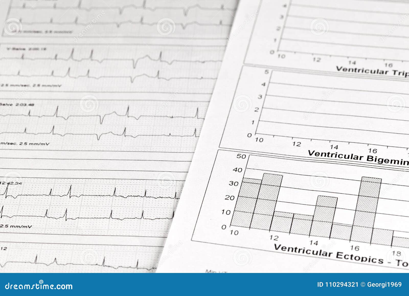 EKG chart on paper stock image. Image of horizontal - 110294321
