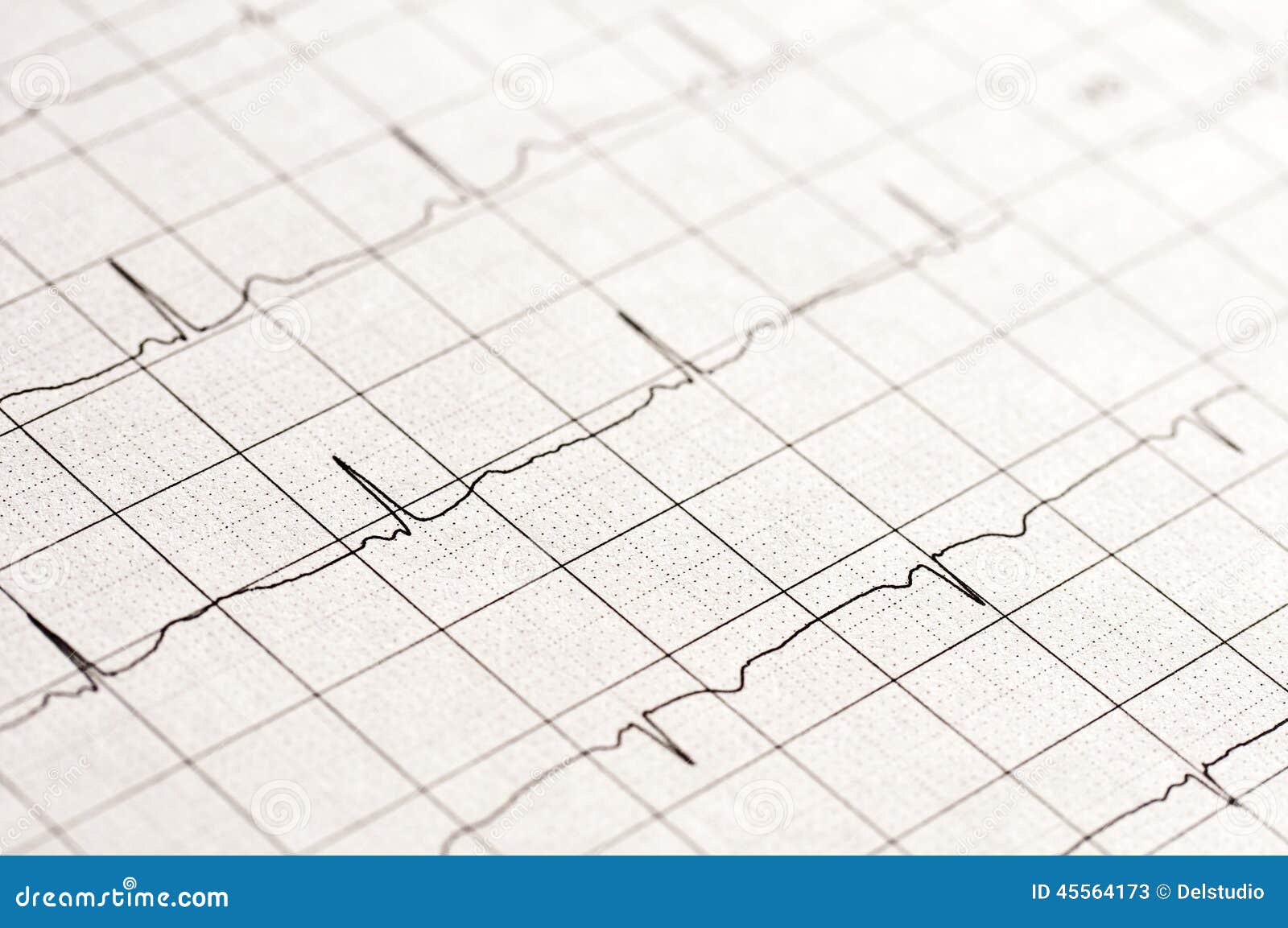 Electrocardiogram stock image. Image of checking, healthy - 45564173