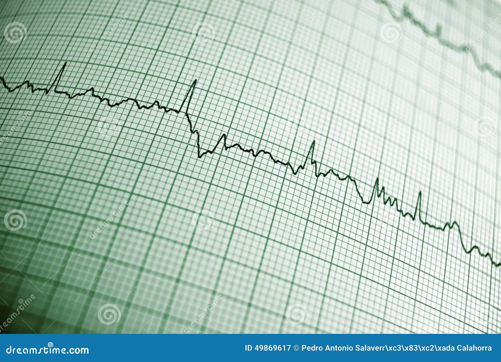 Electrocardiogram stock image. Image of graphic, backdrop - 49869617