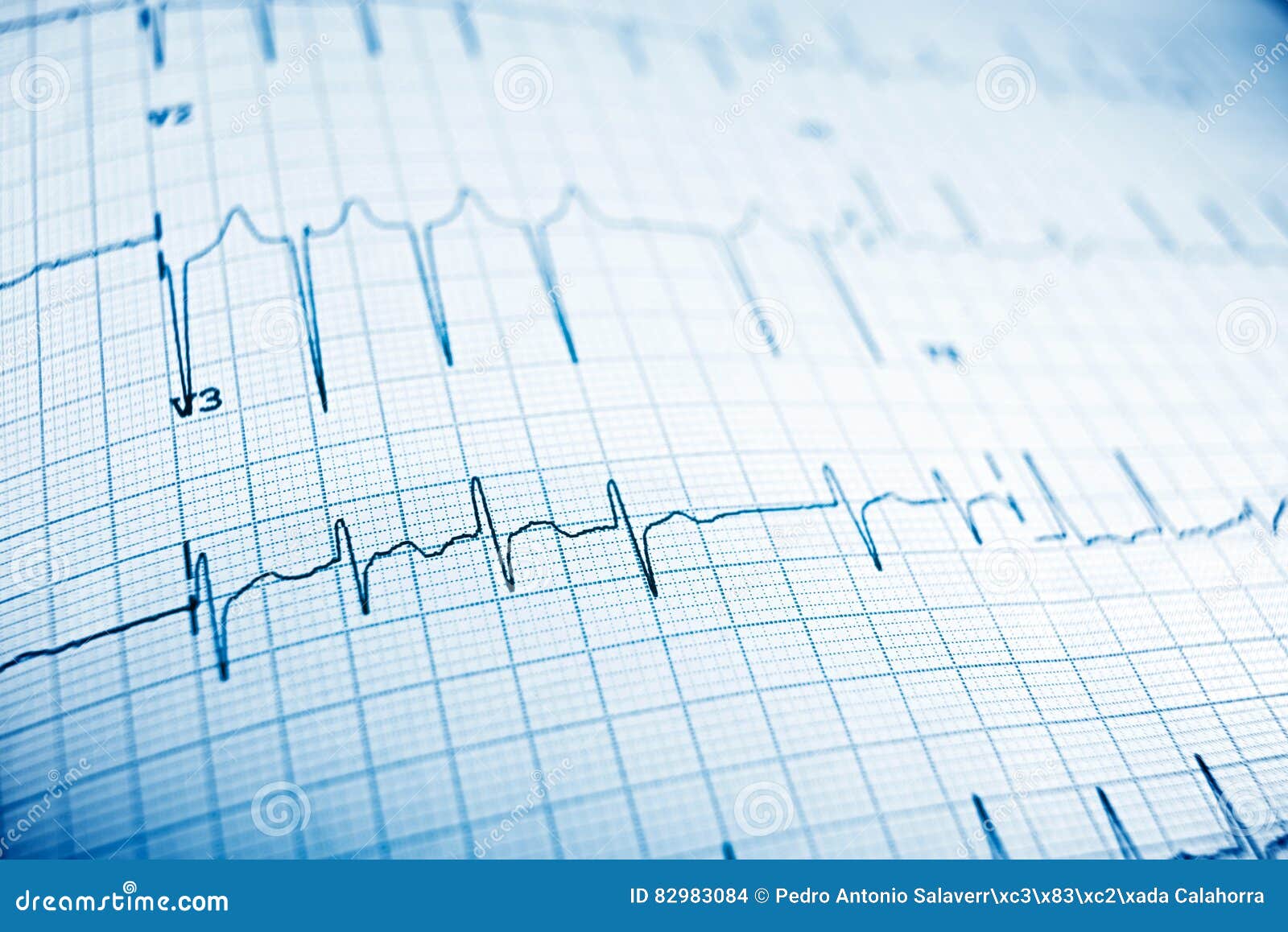 Electrocardiogram stock photo. Image of concept, body - 82983084