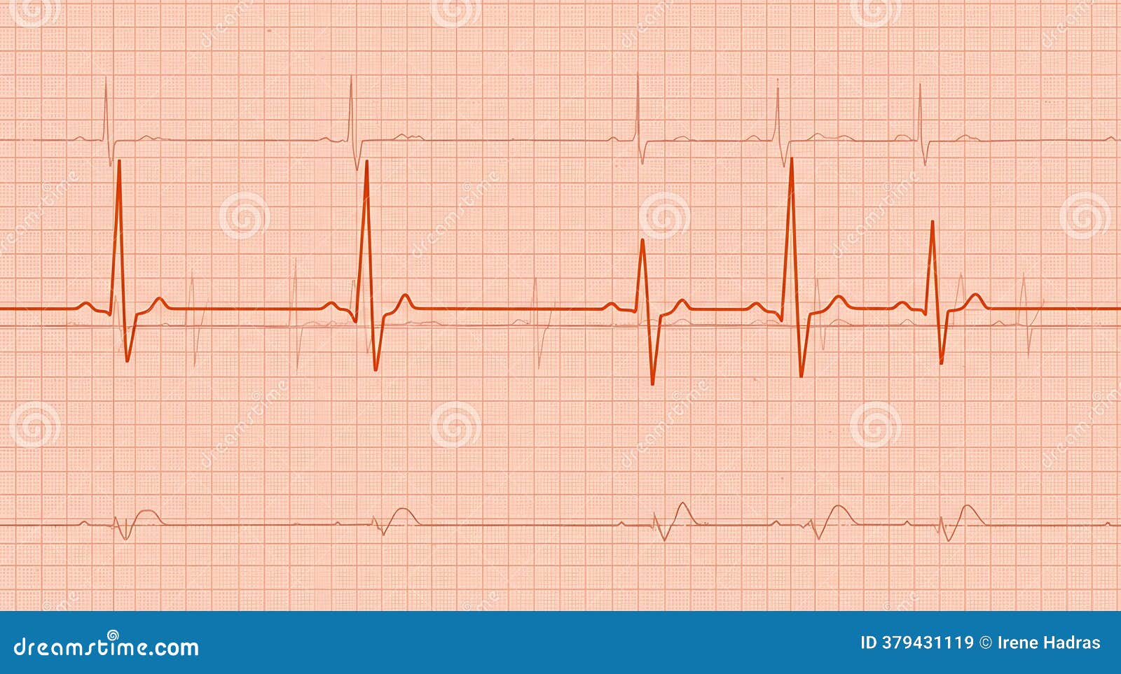 Electrocardiogram Graph Ekg Heart