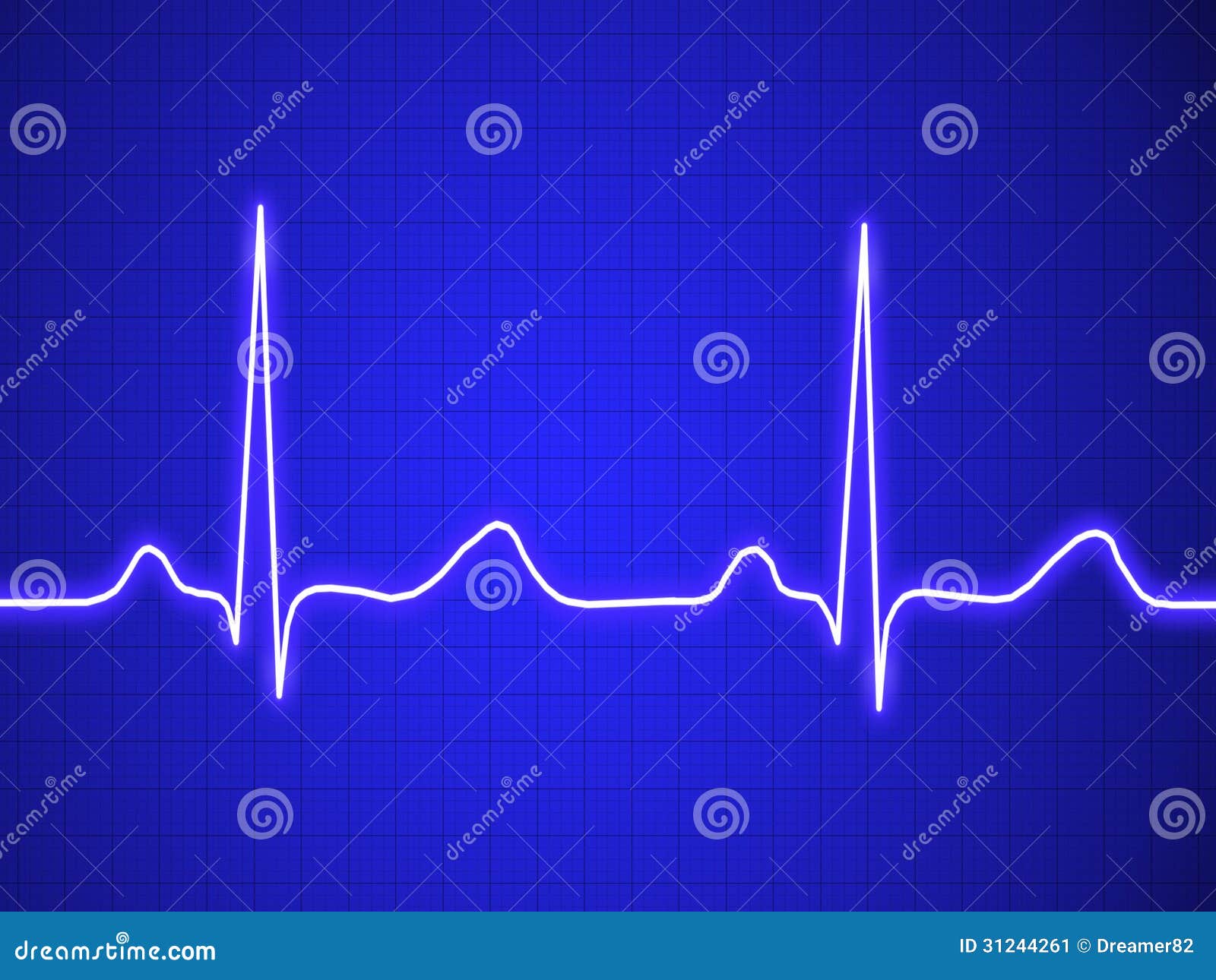 Electrocardiogram, Ecg, Graph, Pulse Tracing Royalty-Free Stock ...