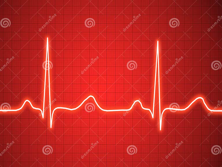 Electrocardiogram, Ecg, Graph, Pulse Tracing Stock Illustration ...
