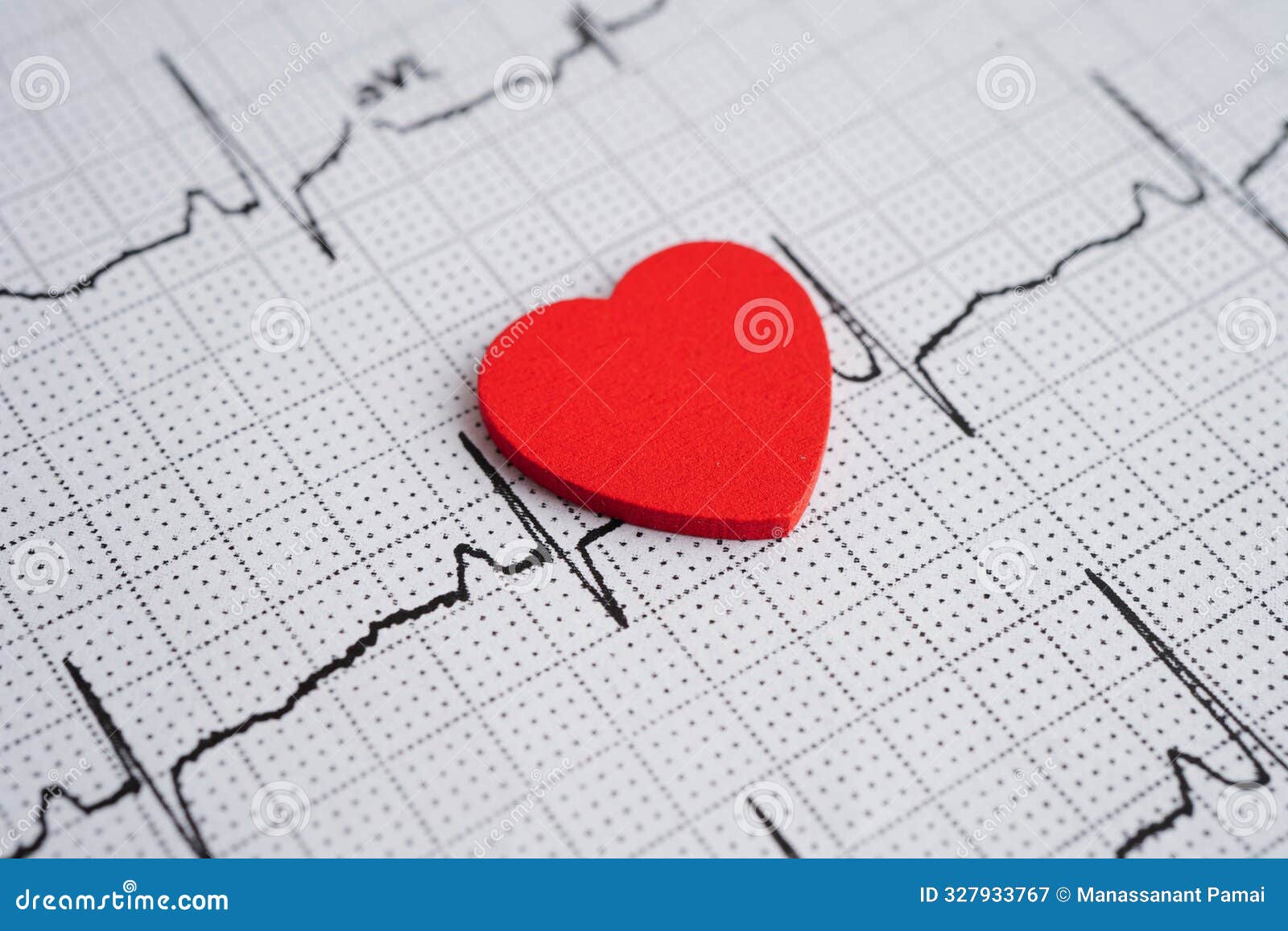 Electrocardiogram (ECG), Heart Wave, Heart Attack, Cardiogram Report ...